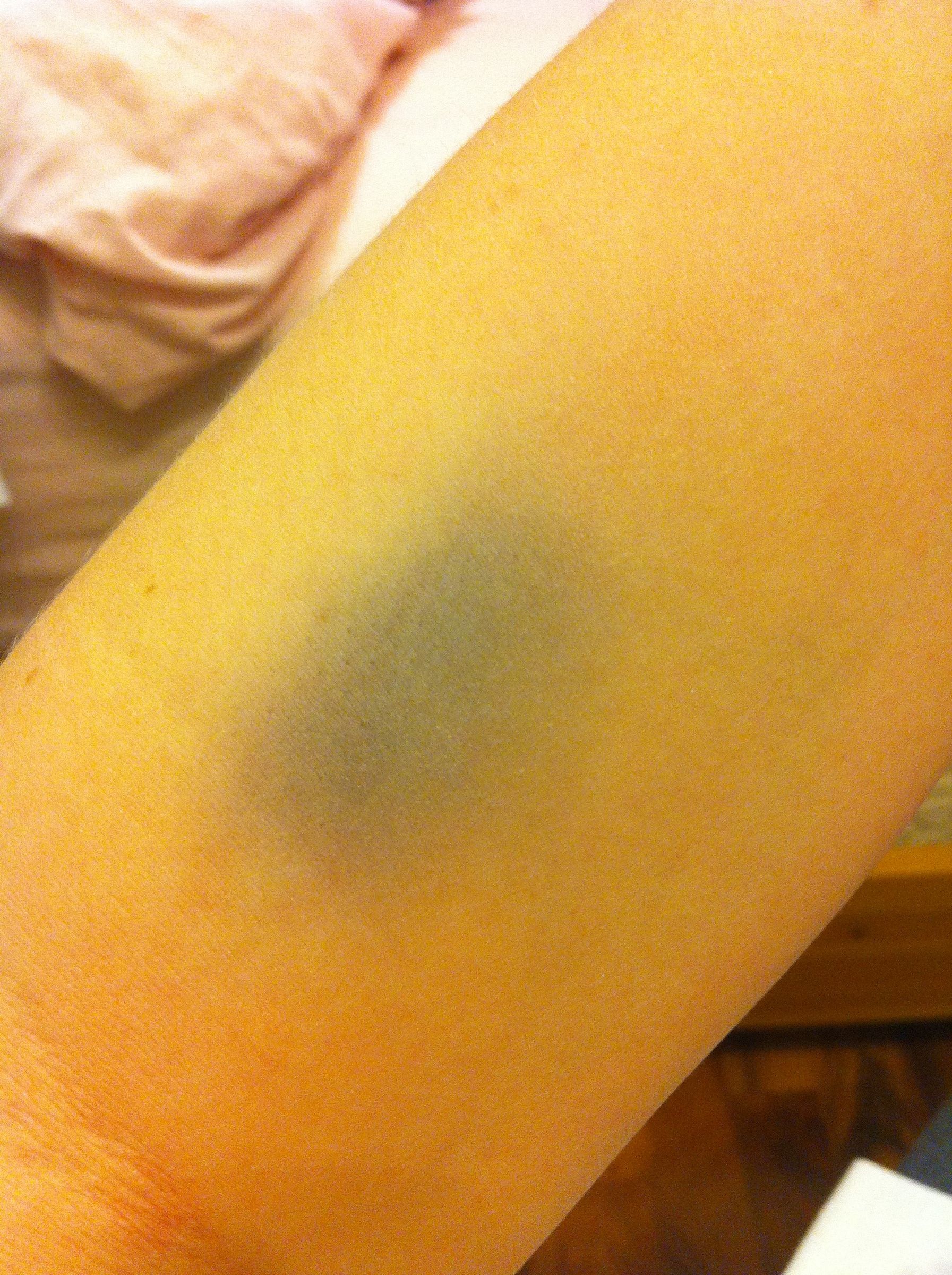 How to Create a Fake Bruise : 6 Steps - Instructables