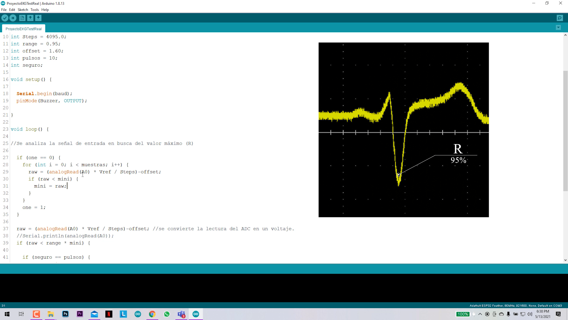 DIY ECG Heart Monitor | Analog Interface + Arduino : 8 Steps ...