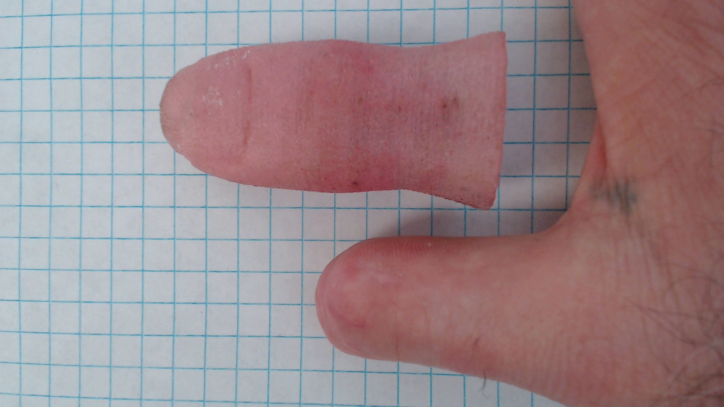 Thumb Prosthesis : 12 Steps (with Pictures) - Instructables