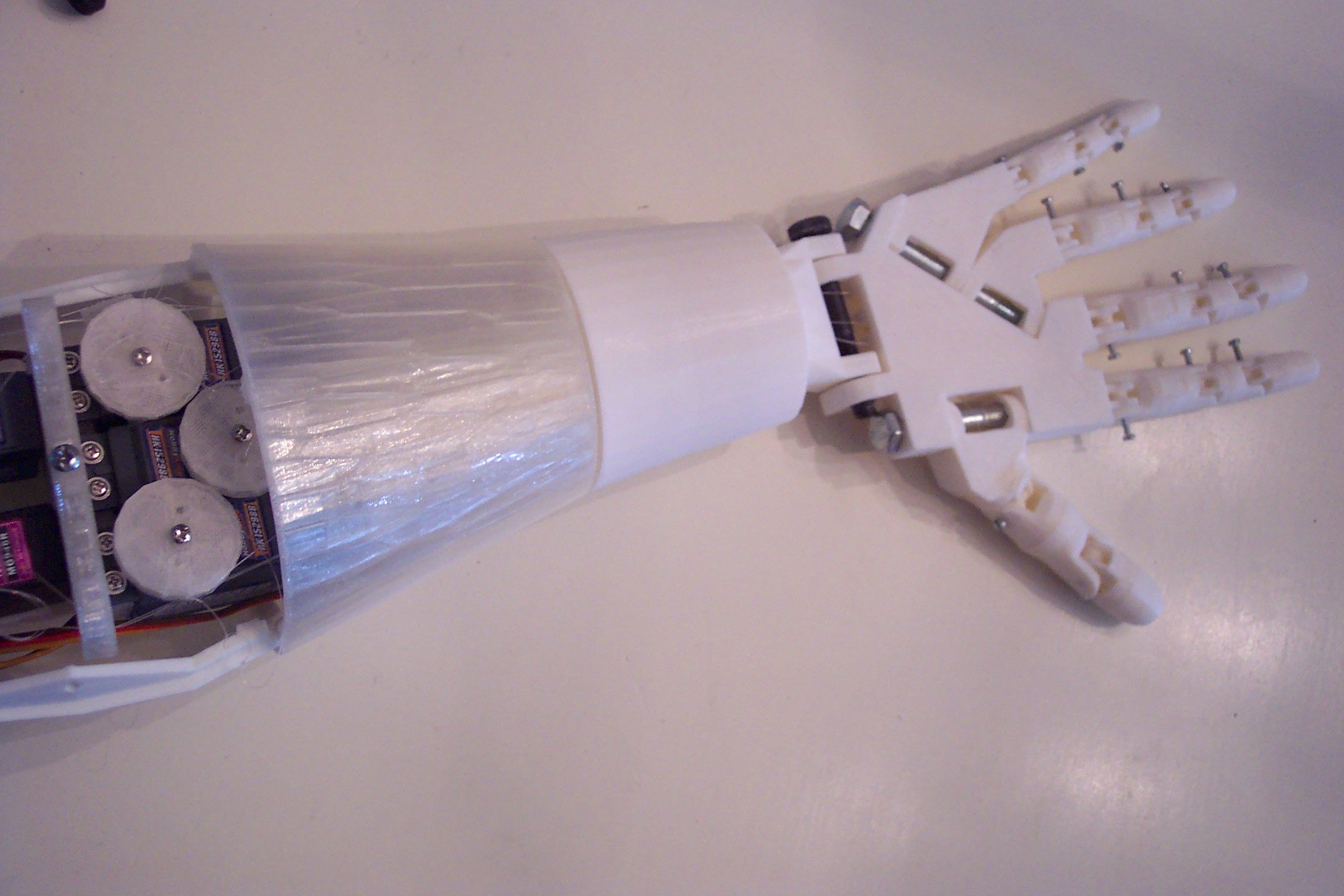 DIY Prosthetic Hand & Forearm (Voice Controlled) : 14 Steps (with ...