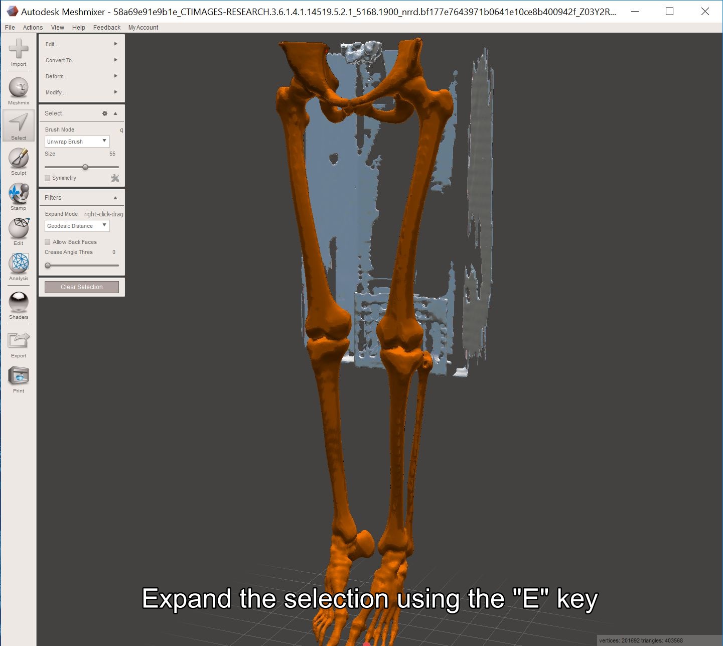 How to Easily and Automatically Convert a CT Scan (DICOM Data) Into a ...