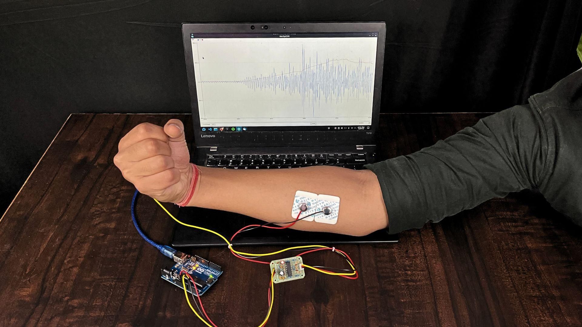 Visualizing Muscle Signals (EMG) Using Most Affordable DIY Muscle Sensor : 9 Steps (with ...