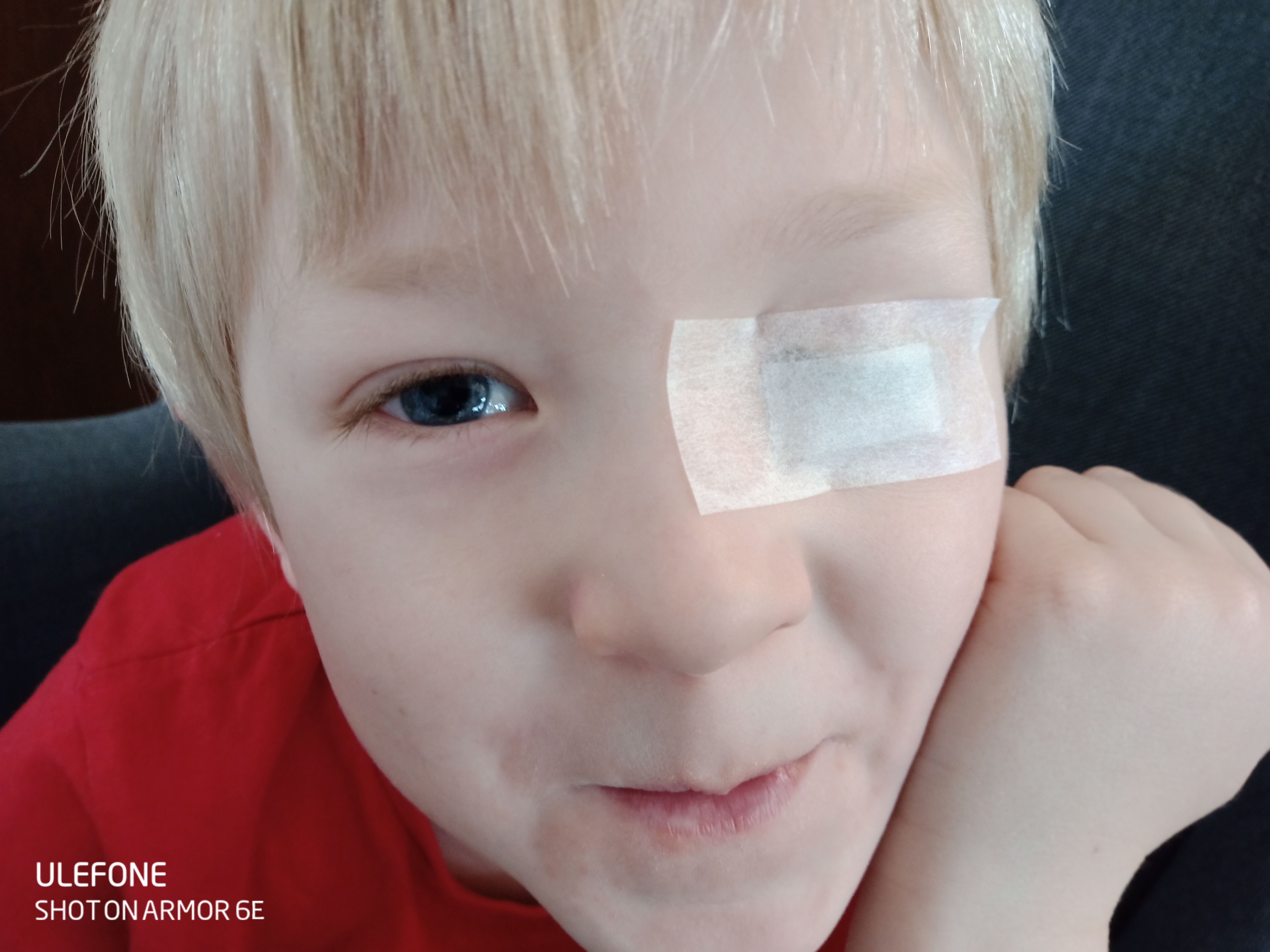 Easy Amblyopia Eye Patch - and Teaching Kids Money Saving : 6 Steps ...