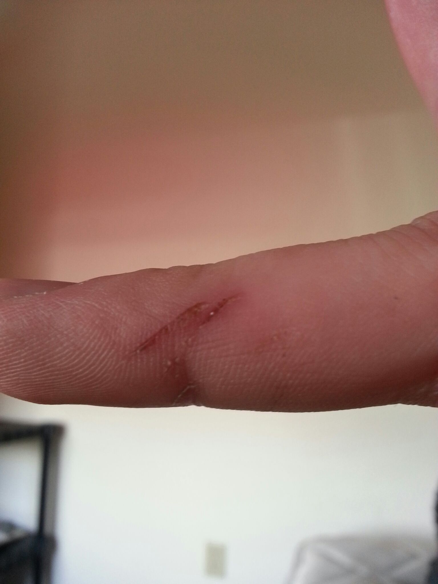 Rope Saw : 11 Steps - Instructables