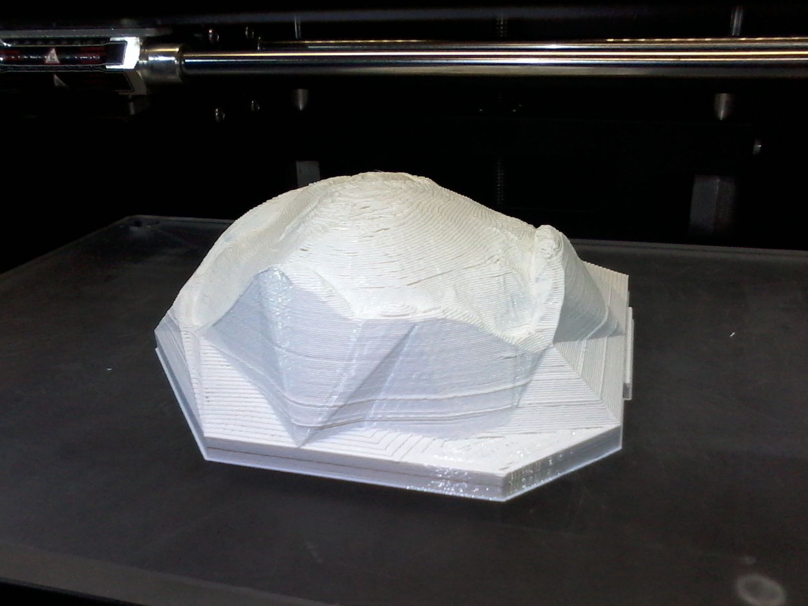Surgery + Fully 3D Printed Mold : 7 Steps (with Pictures) - Instructables