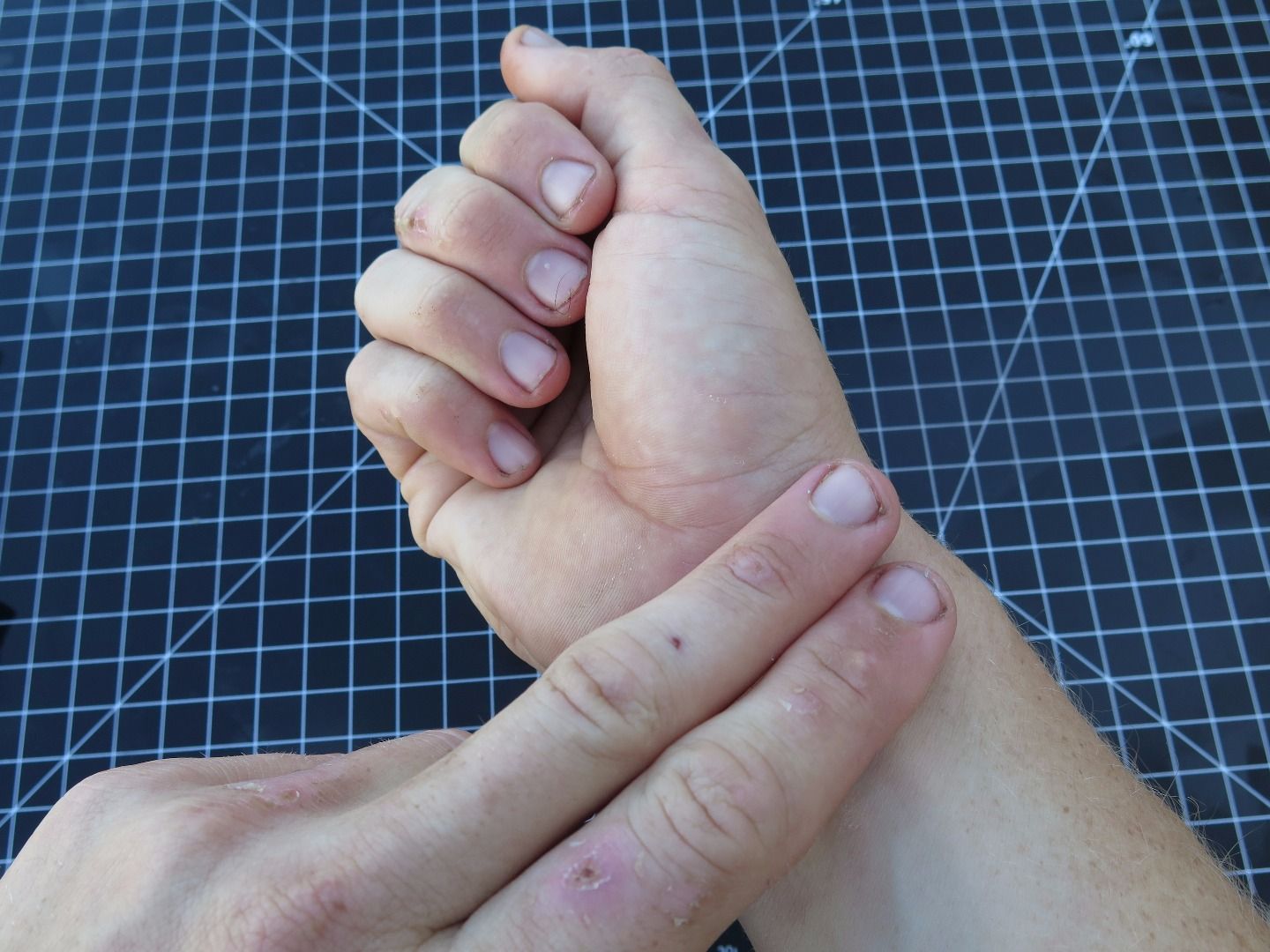 Heart Dissection : 8 Steps (with Pictures) - Instructables