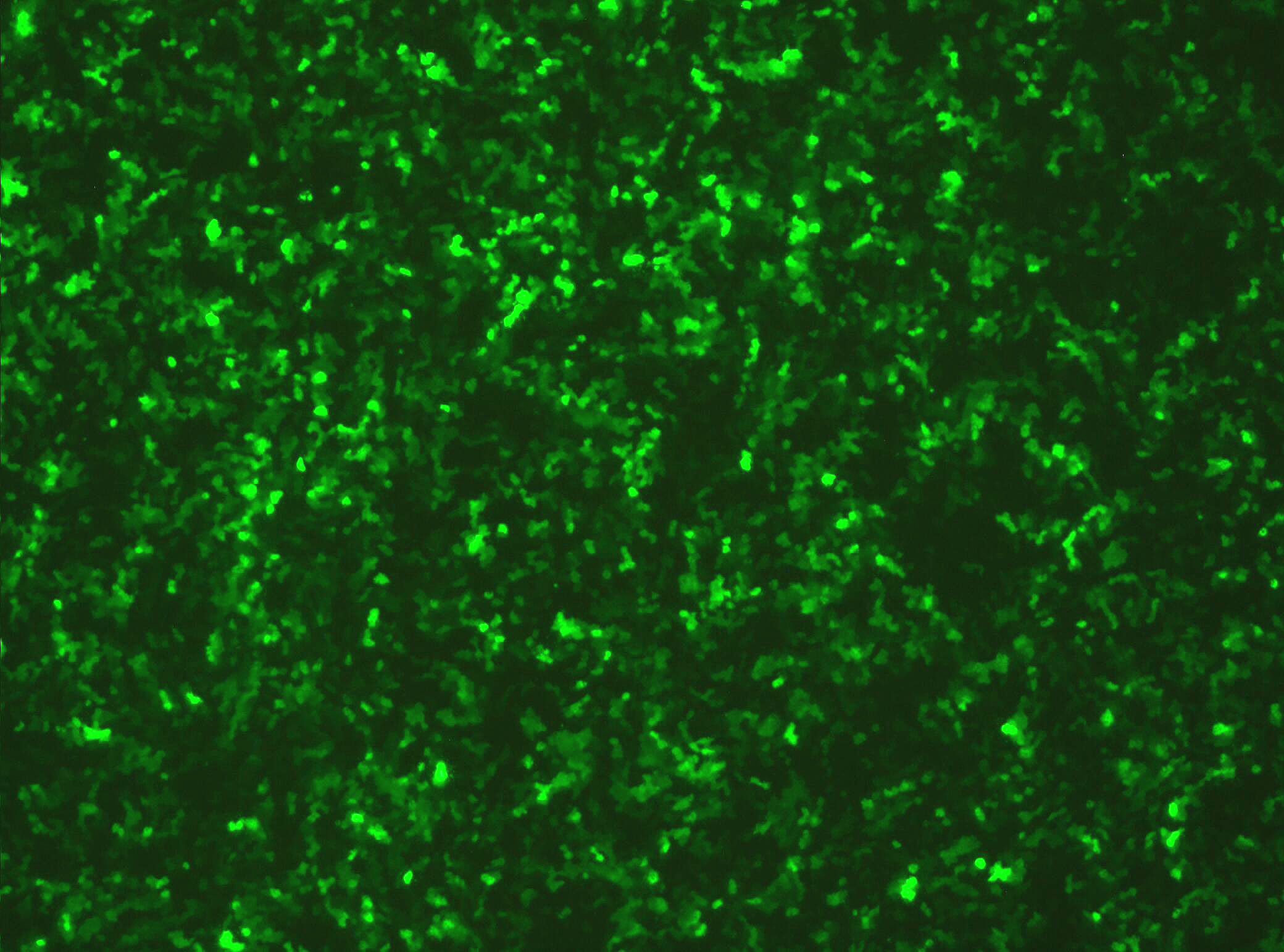 Let the Cells Exhibit Bright Green Light -- in Situ GFP Transfection ...