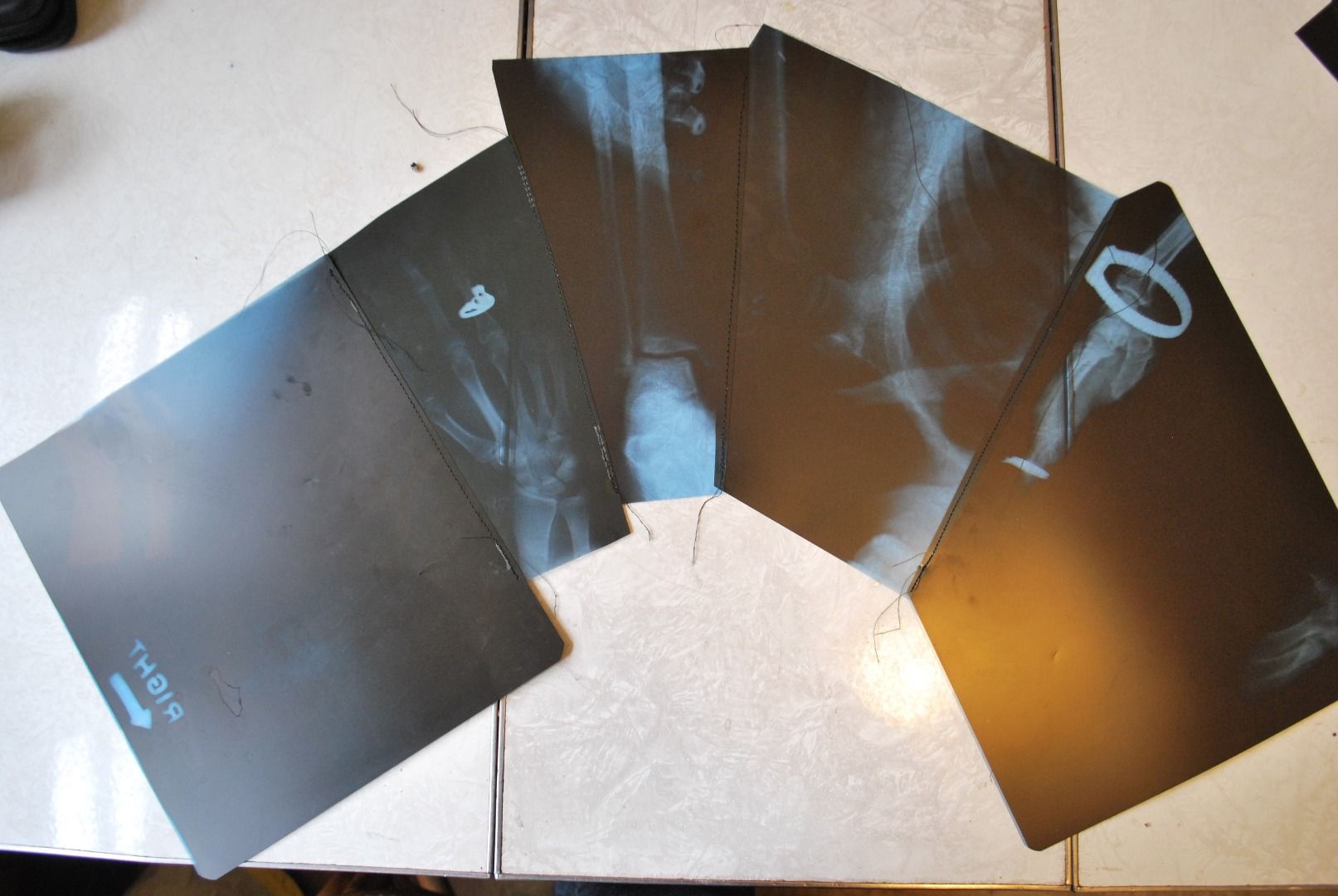 X-Ray Lamp Shade : 8 Steps (with Pictures) - Instructables