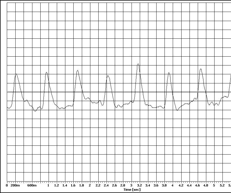 Another Heart Rate Monitor : 3 Steps - Instructables