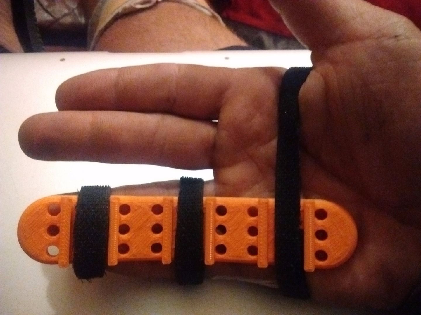 3D Print a Splint : 5 Steps (with Pictures) - Instructables