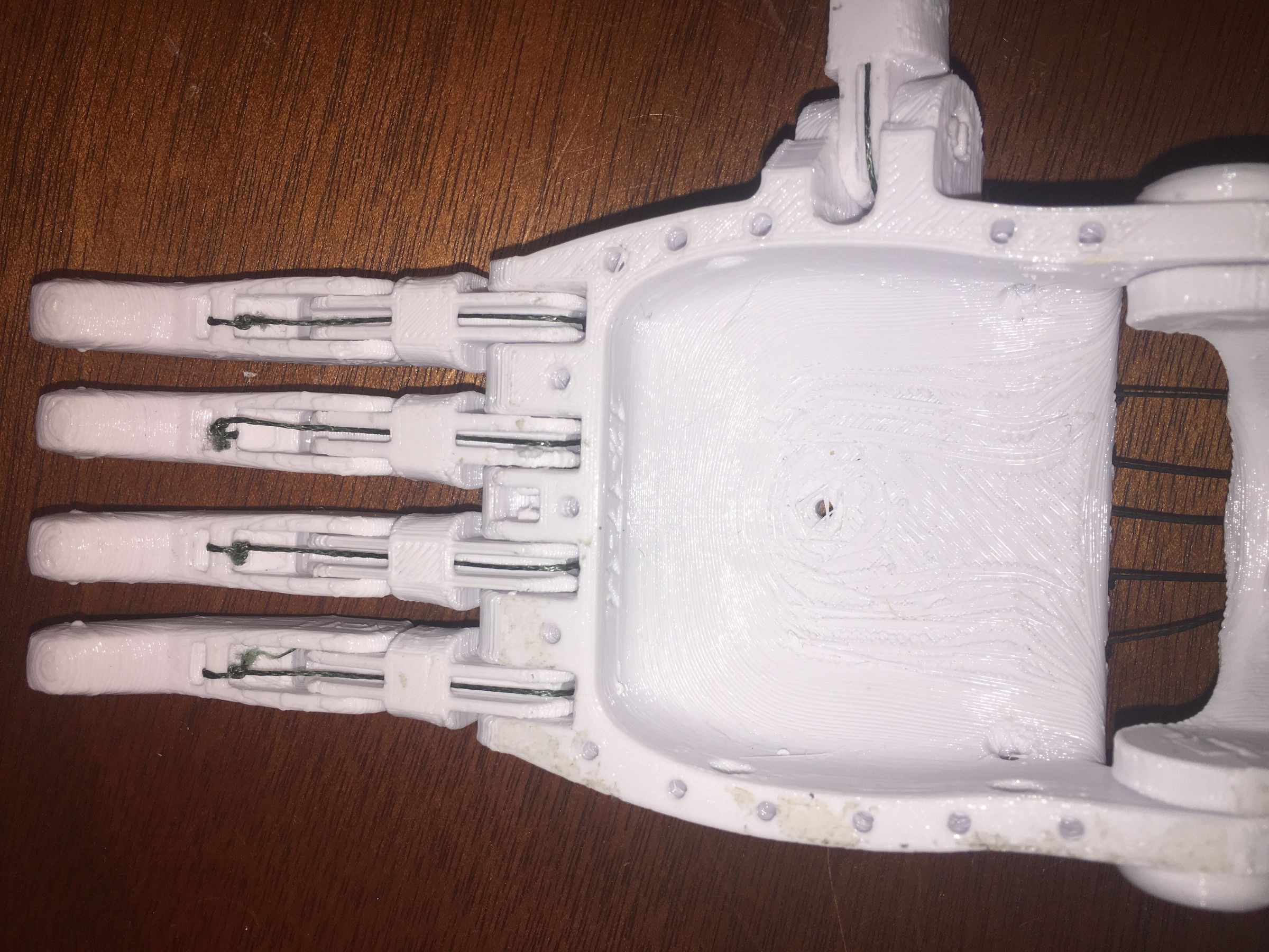 Servo Controlled Prosthetic Hand : 8 Steps - Instructables