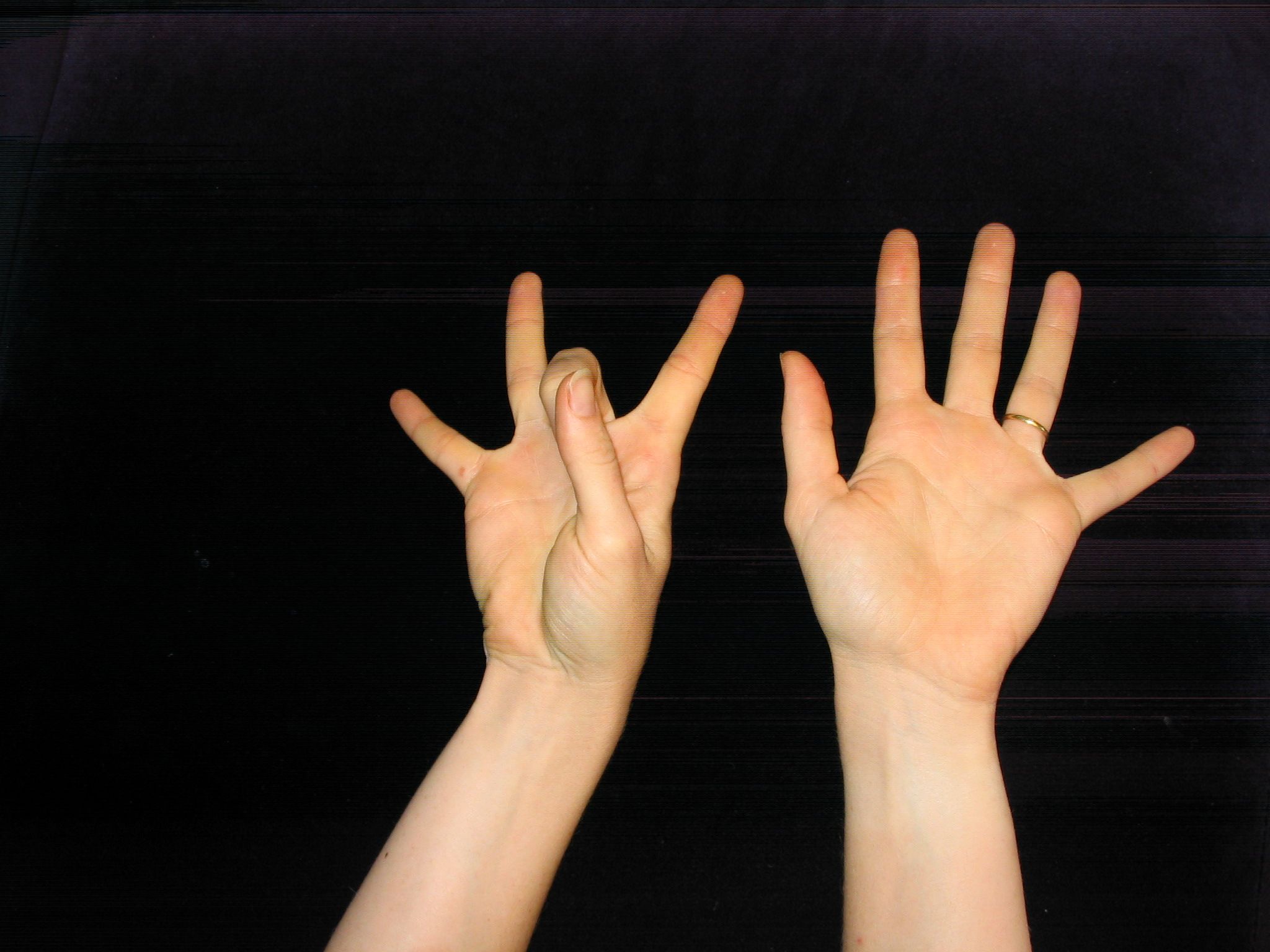 Mouse Toe Numbering Scheme : 5 Steps - Instructables