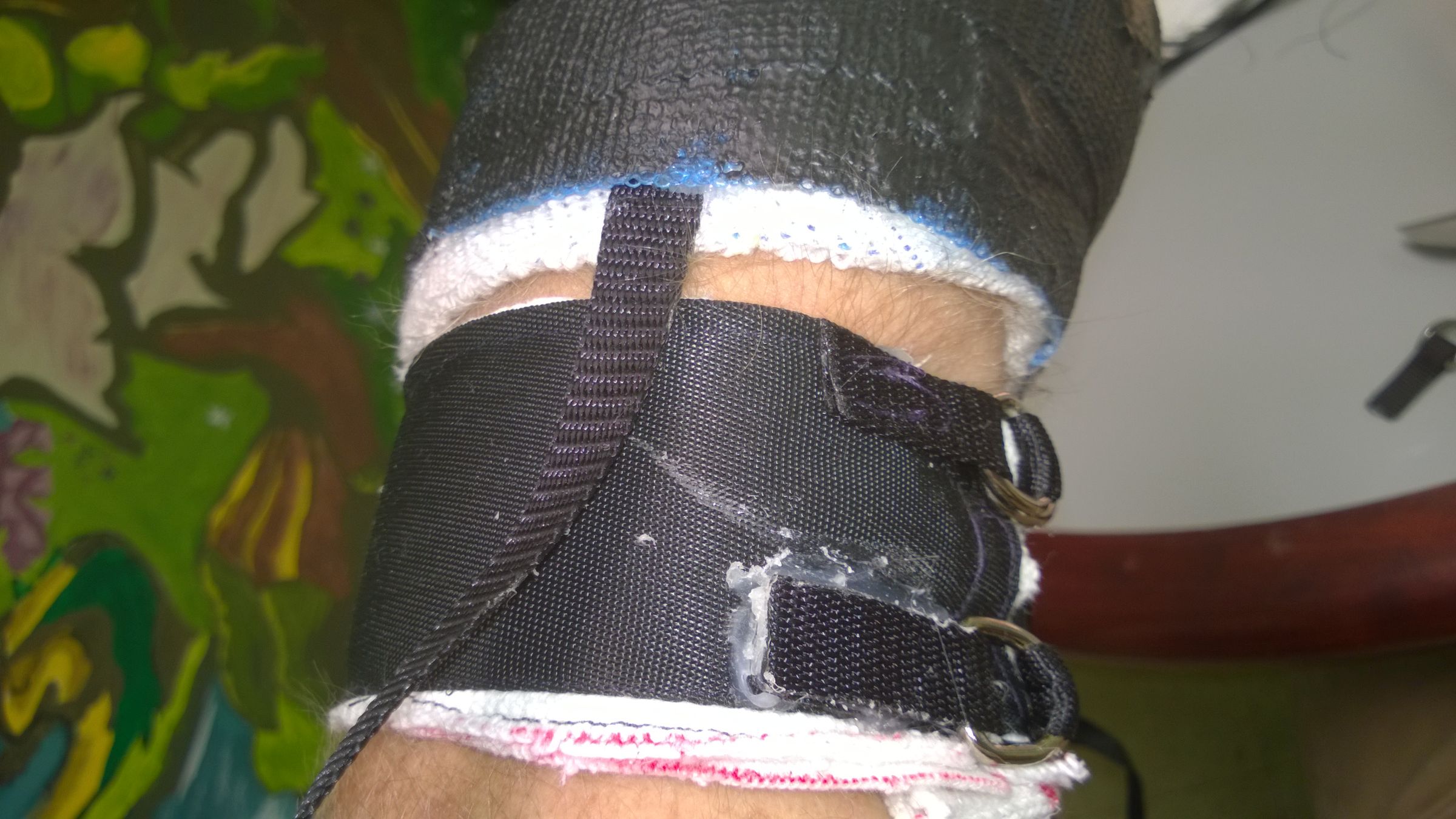 Fuzzy Stump Socket Prosthetic : 12 Steps (with Pictures) - Instructables