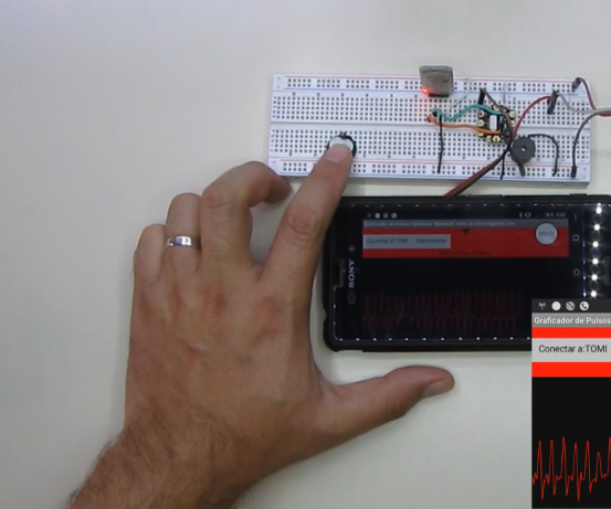 Visualize Cardiac Graphics on Smartphone With Cheapduino and Pulse ...