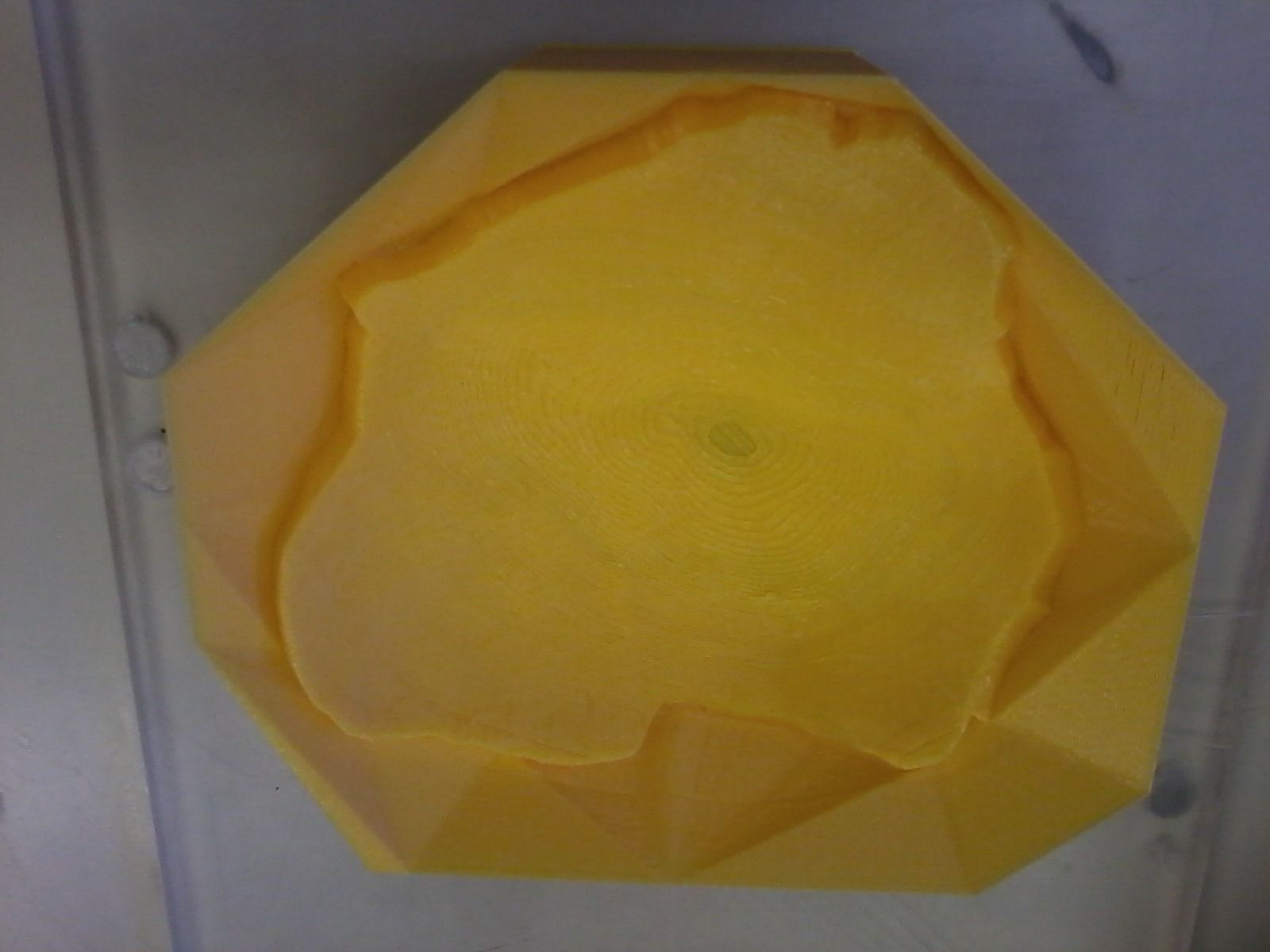 Surgery + Fully 3D Printed Mold : 7 Steps (with Pictures) - Instructables