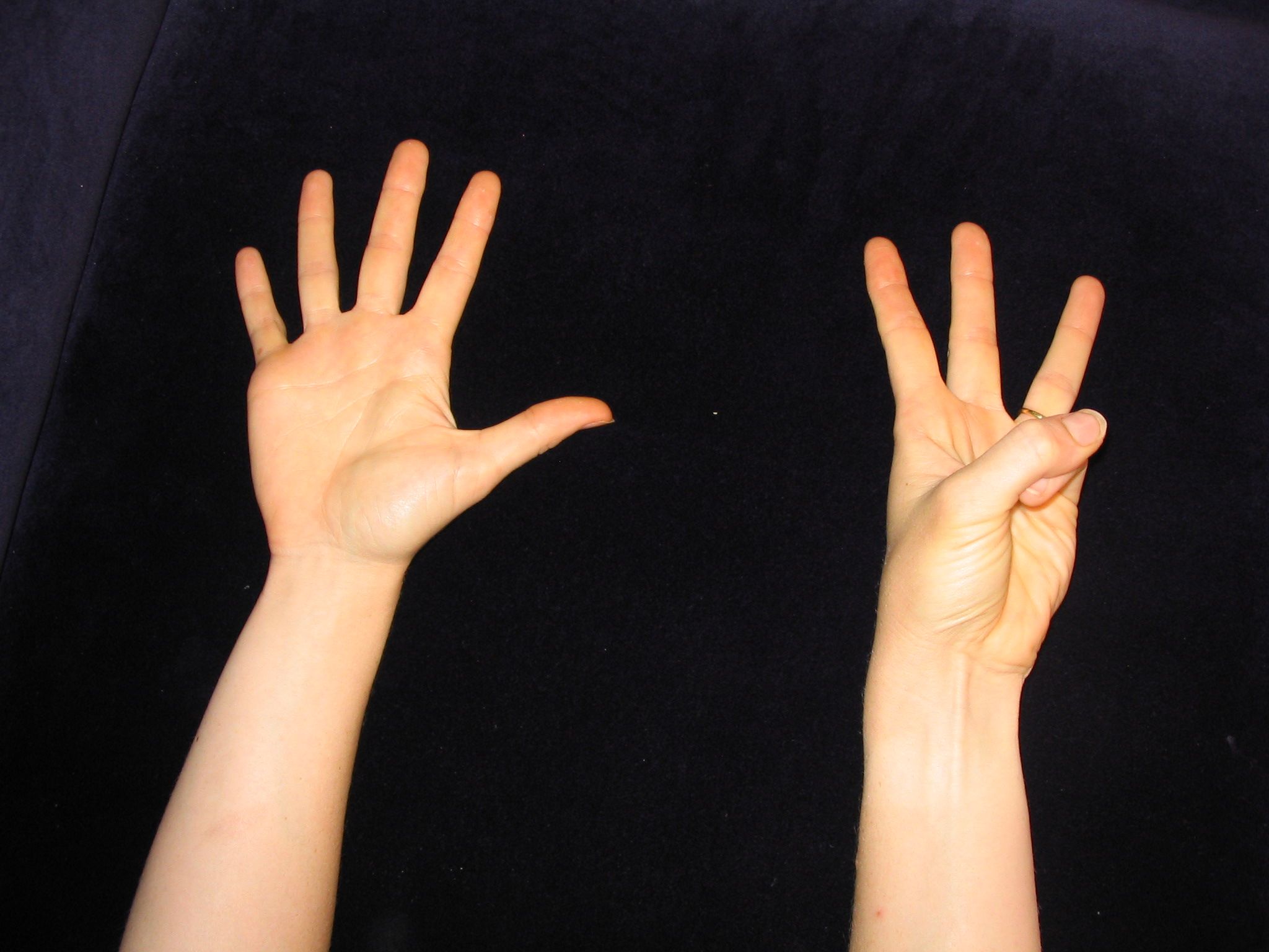 Mouse Toe Numbering Scheme : 5 Steps - Instructables