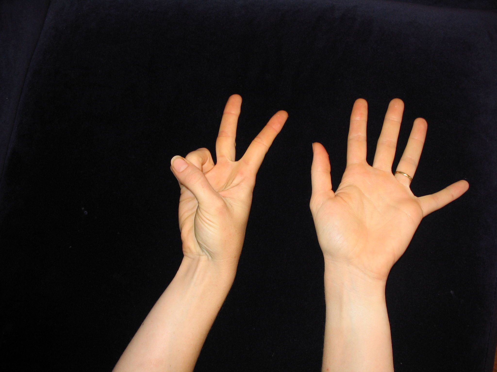 Mouse Toe Numbering Scheme : 5 Steps - Instructables