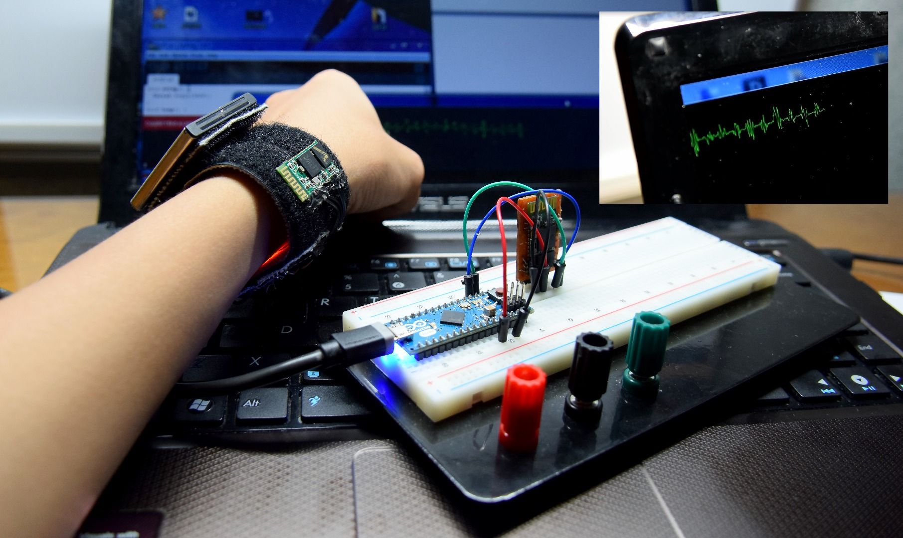 HealthBand: a Remotely Monitored Health Status Bracelet : 17 Steps ...