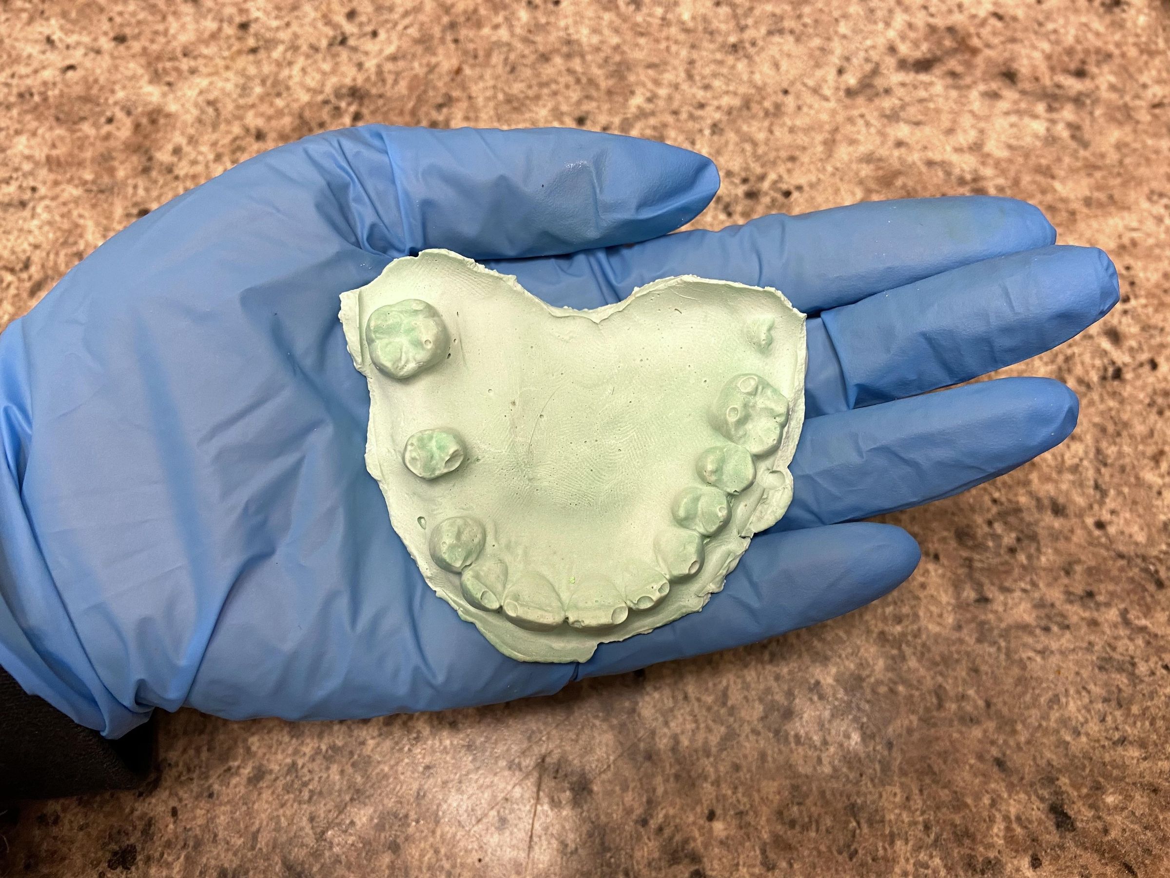 DIY Dentures / Temporary Tooth : 6 Steps - Instructables