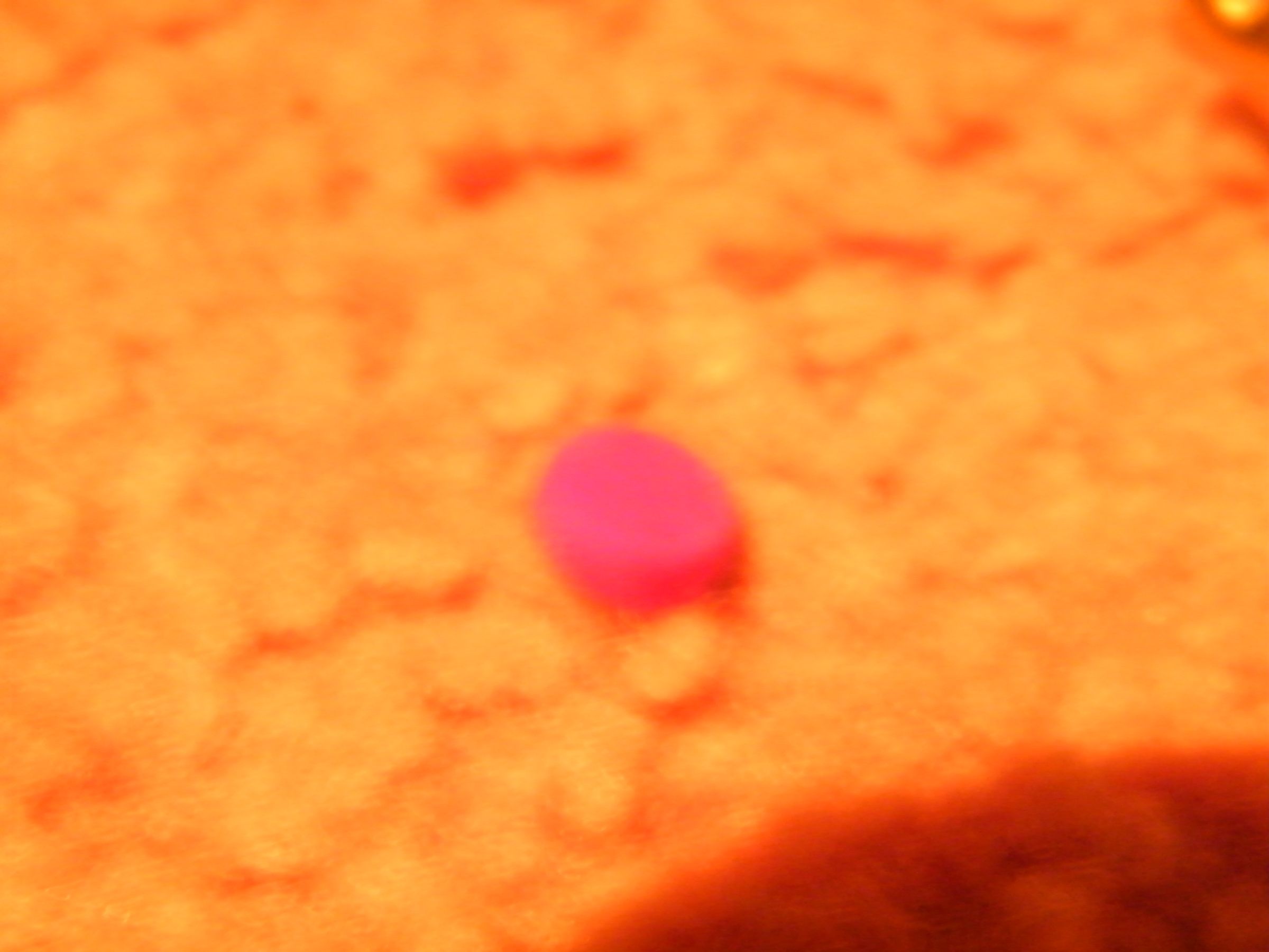 Replacing a Broken Button on Electronical Car Keys. : 4 Steps ...