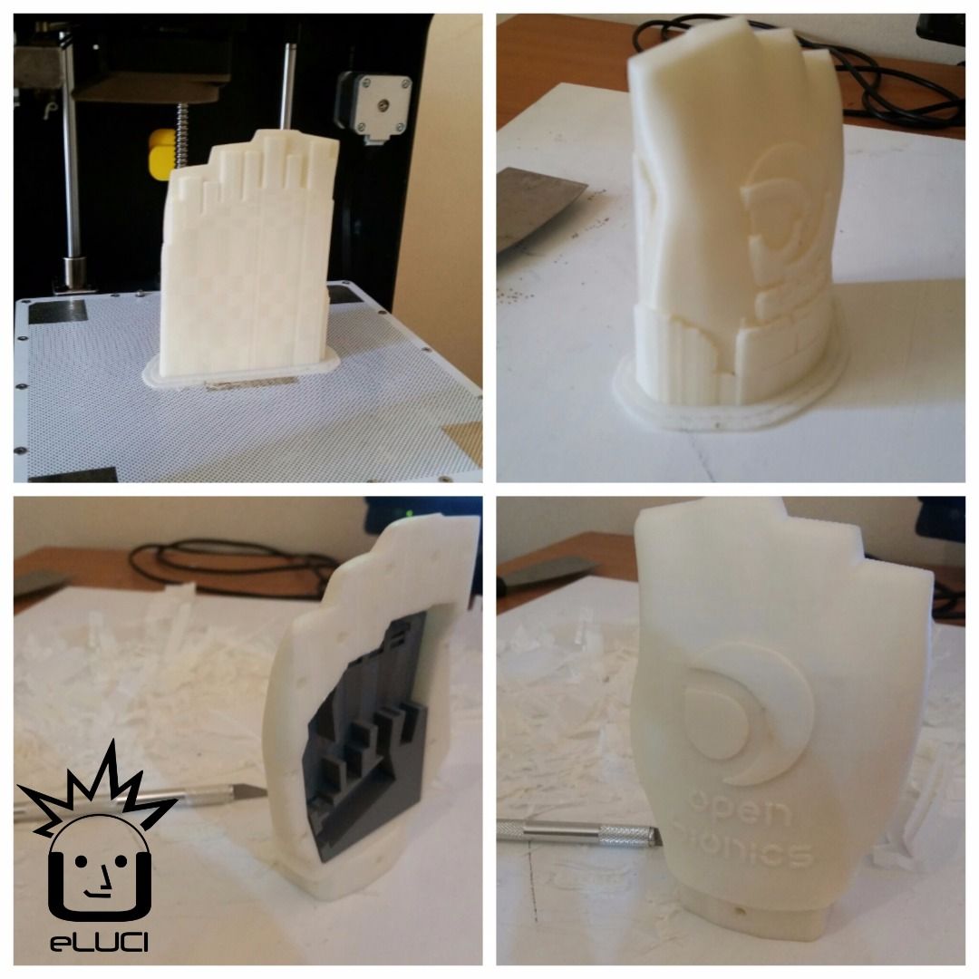 Ada Robotic Hand - Open Bionics : 8 Steps (with Pictures) - Instructables