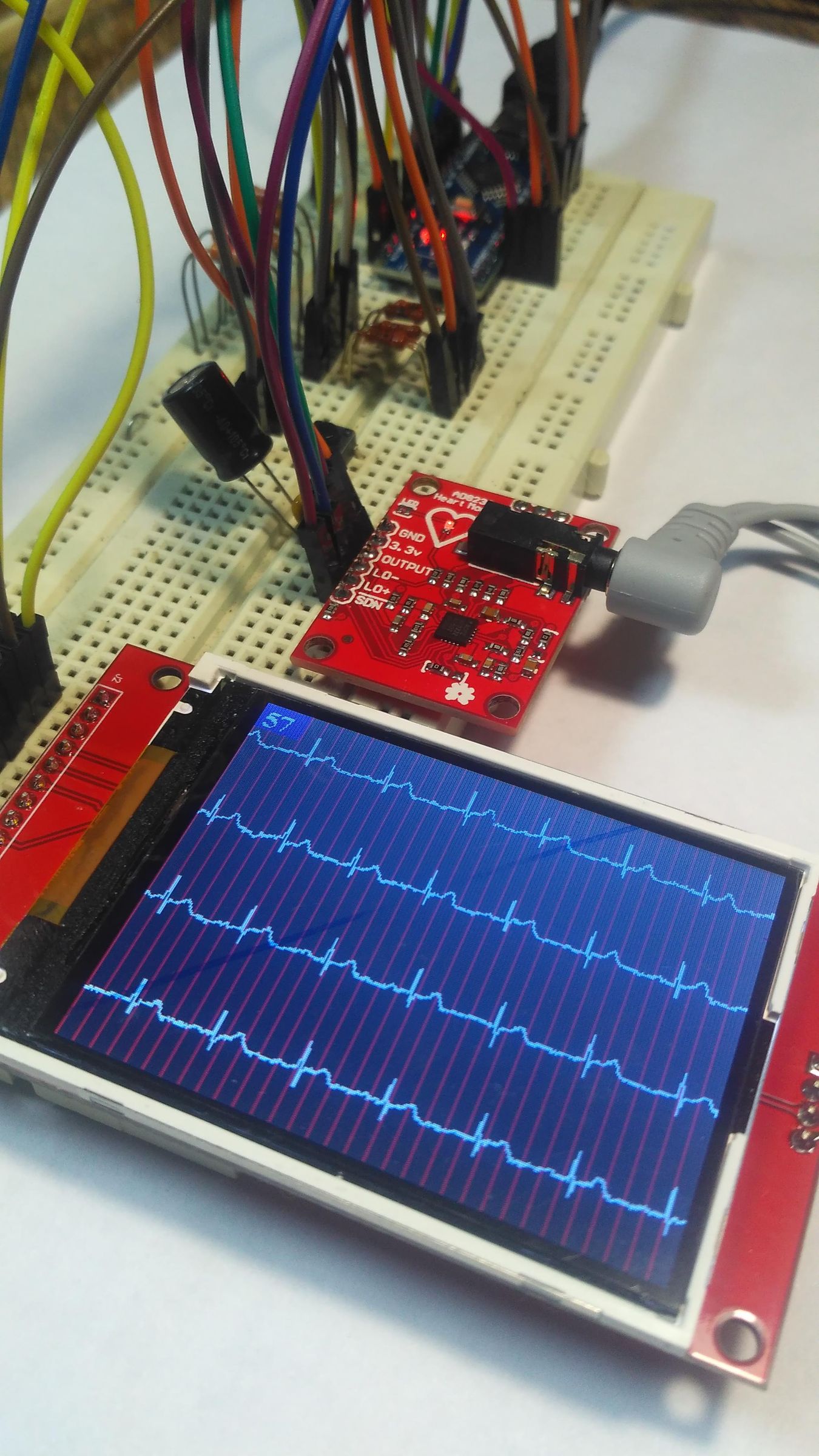 ECG Display With Arduino : 13 Steps (with Pictures) - Instructables
