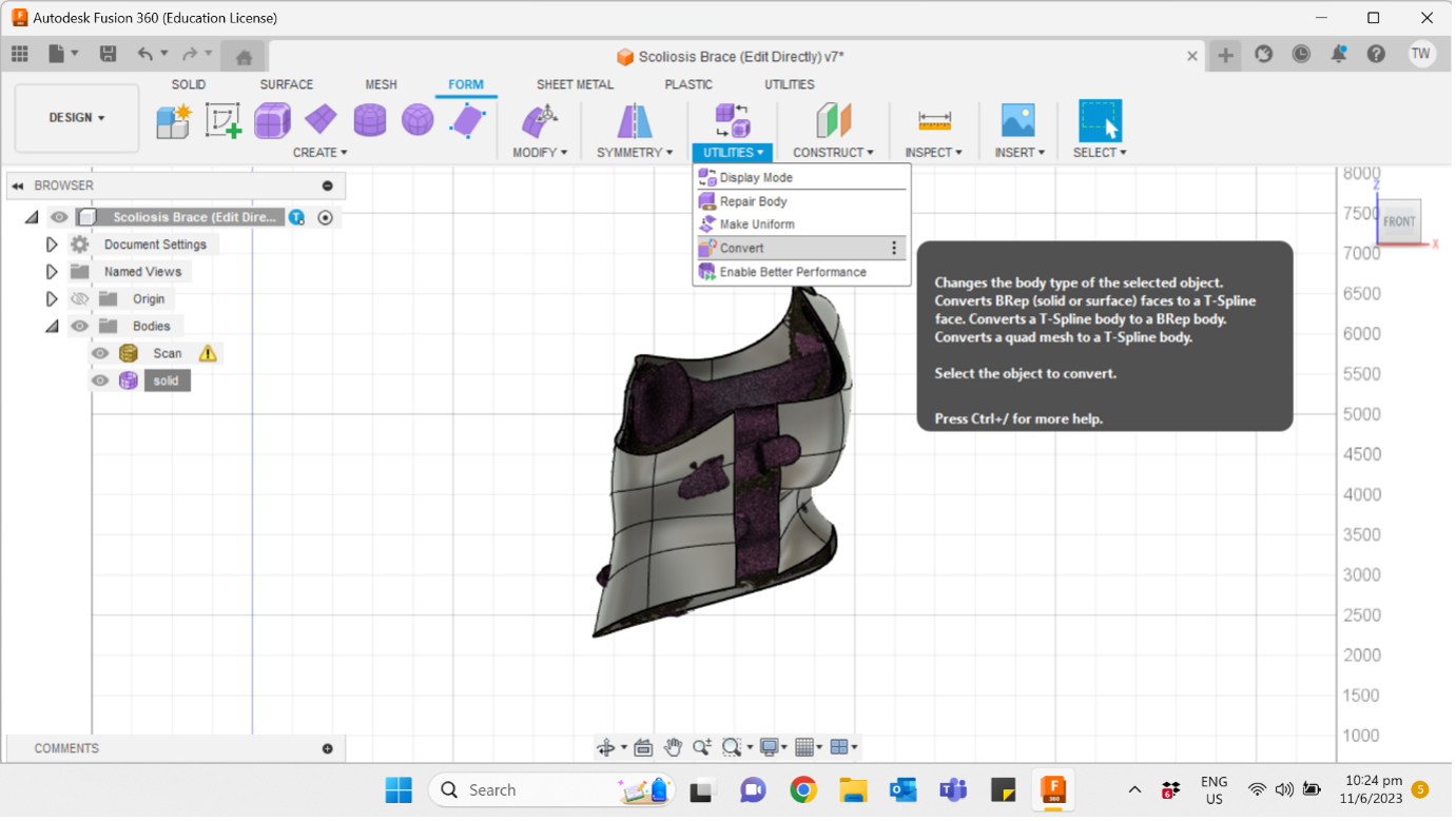 3D Printed Back Brace for Scoliosis : 7 Steps (with Pictures ...