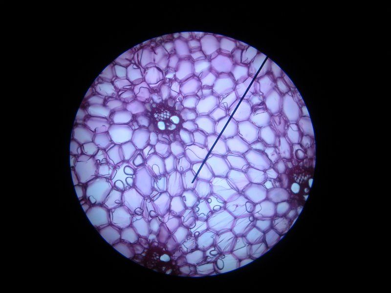 Microscope Photography With Webcam or Point-and-shoot Camera : 8 Steps ...