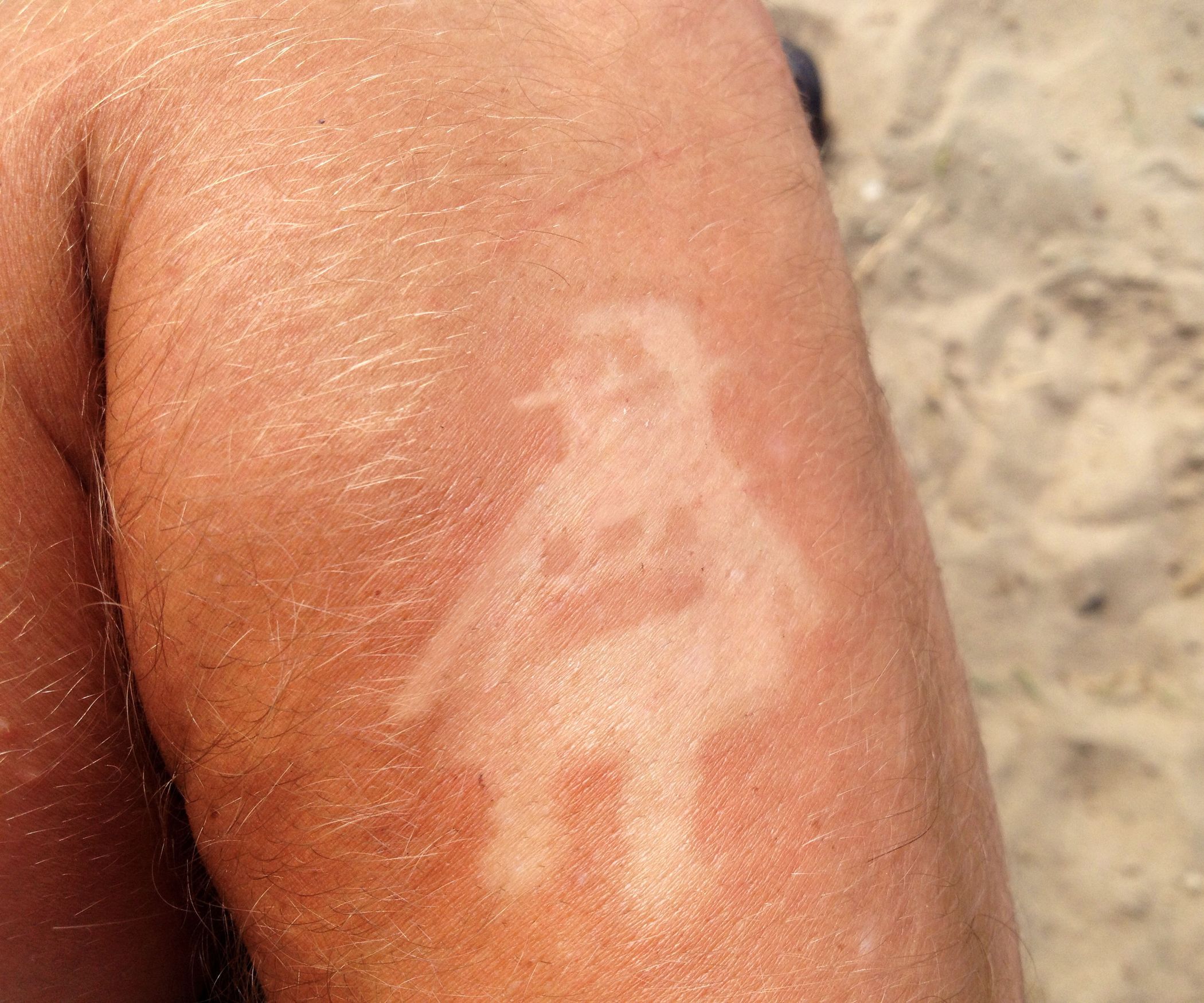 Sun Tattoo : 6 Steps (with Pictures) - Instructables
