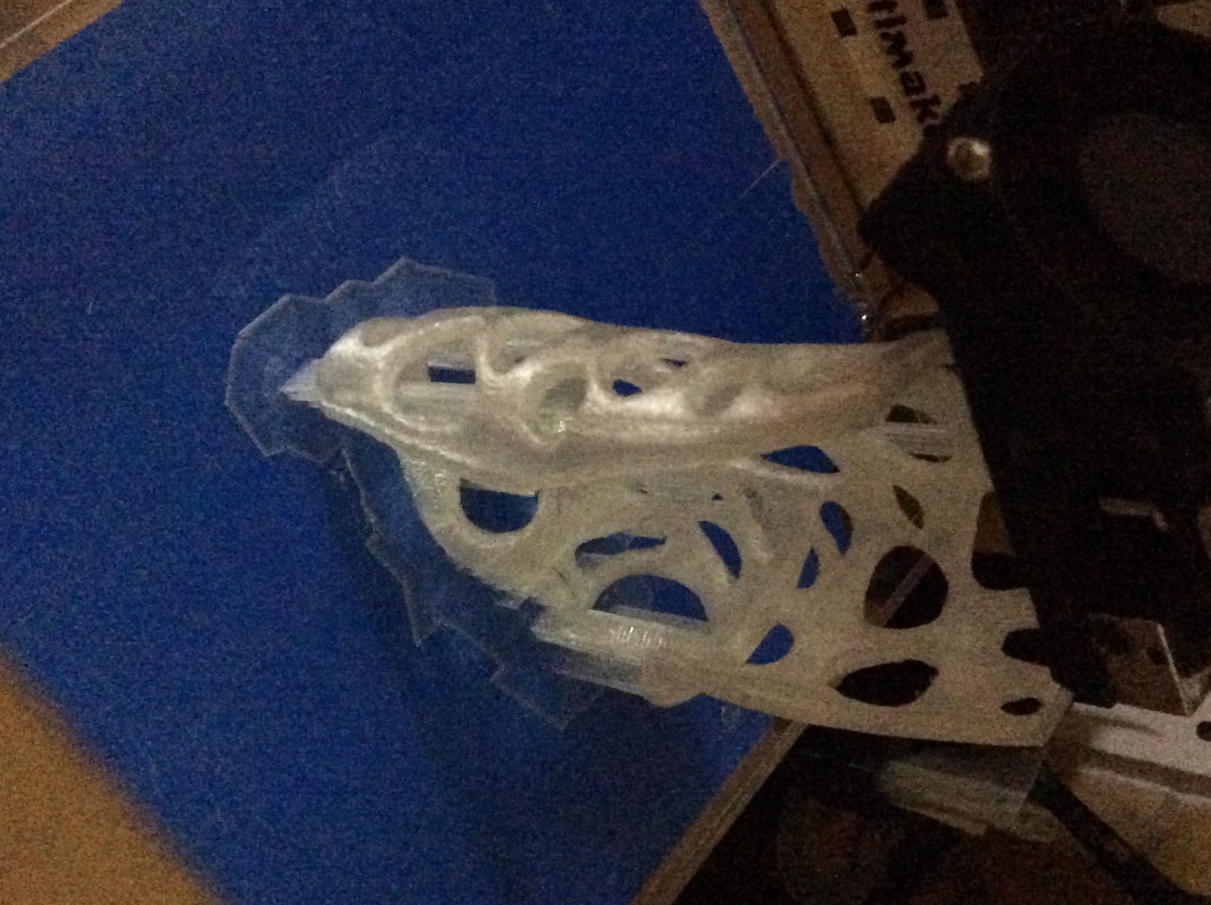 3D Printed Wrist Orthosis : 12 Steps (with Pictures) - Instructables