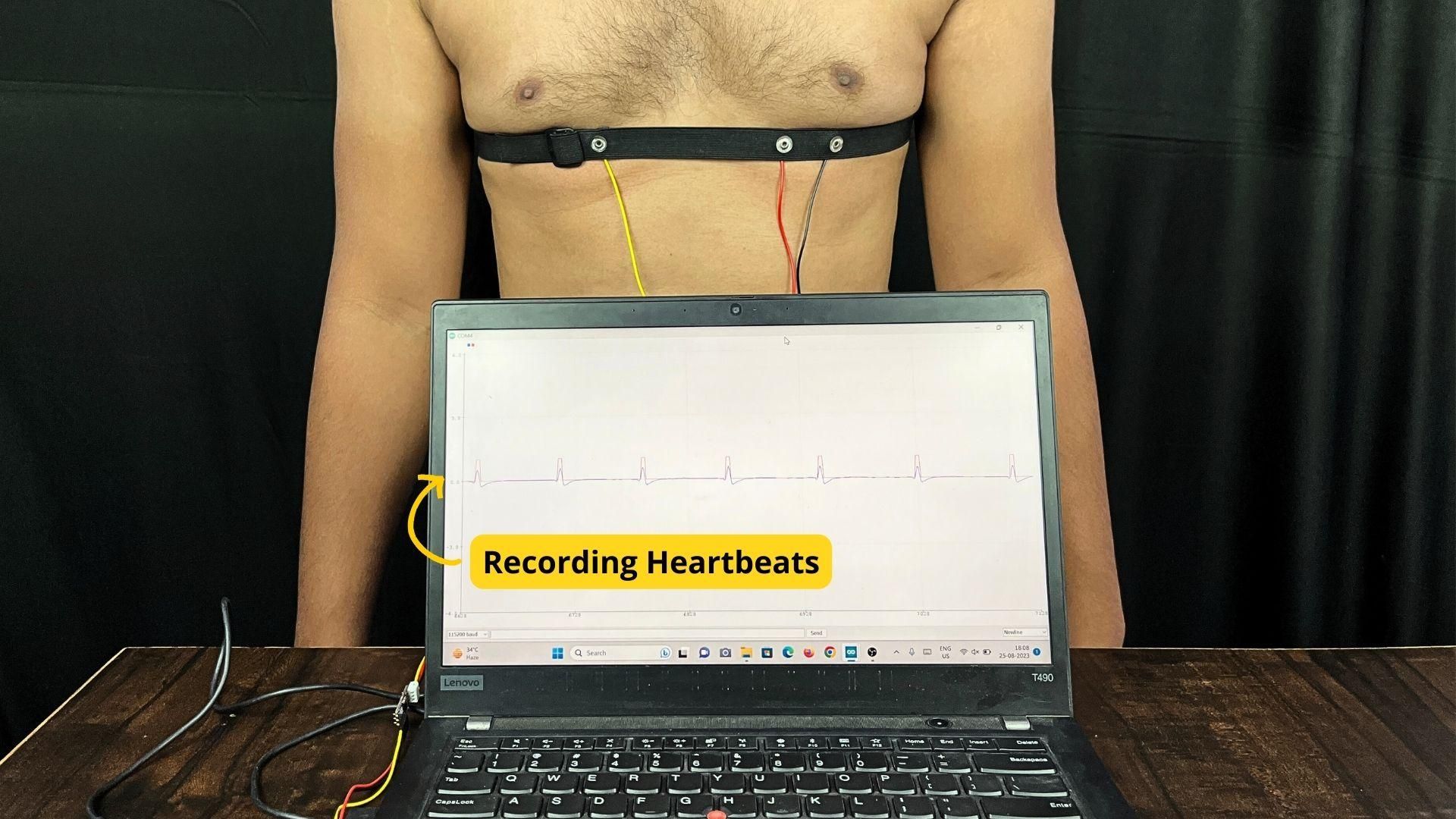 Detecting Heart Beats Using BioAmp EXG Pill : 9 Steps (with Pictures ...