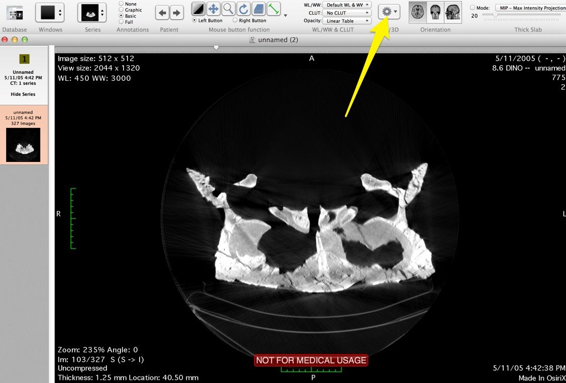 How to Convert Medical Scan Data Into a 3D Printable Model (also ...