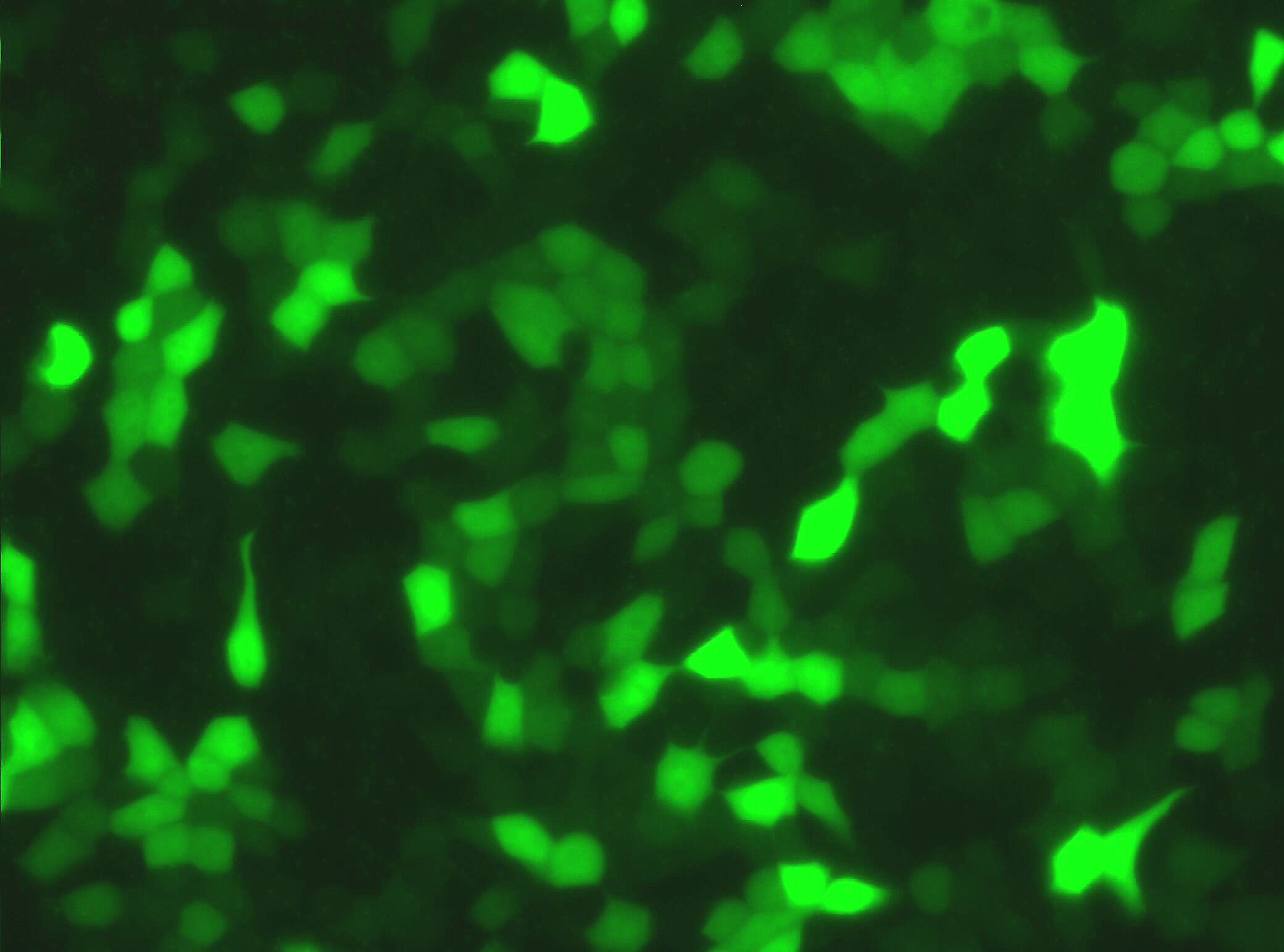 Let the Cells Exhibit Bright Green Light -- in Situ GFP Transfection ...
