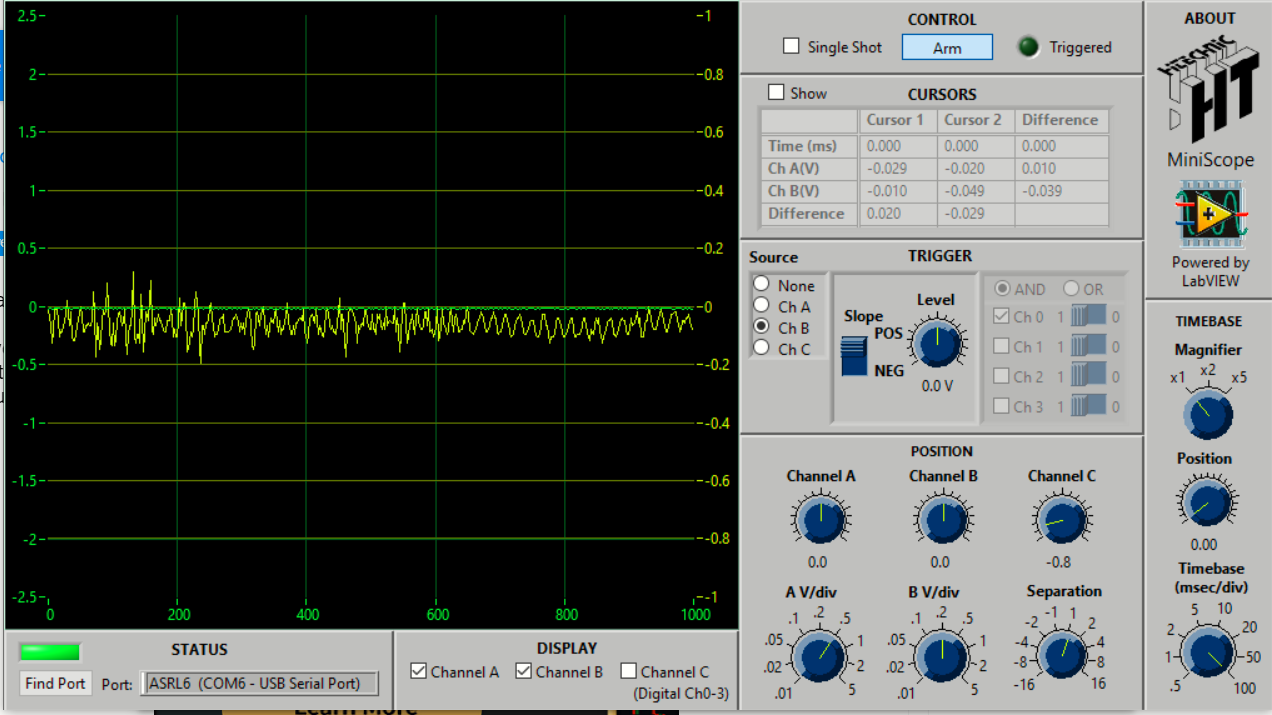 Simple Dry Electrode EMG for Arduino : 4 Steps - Instructables