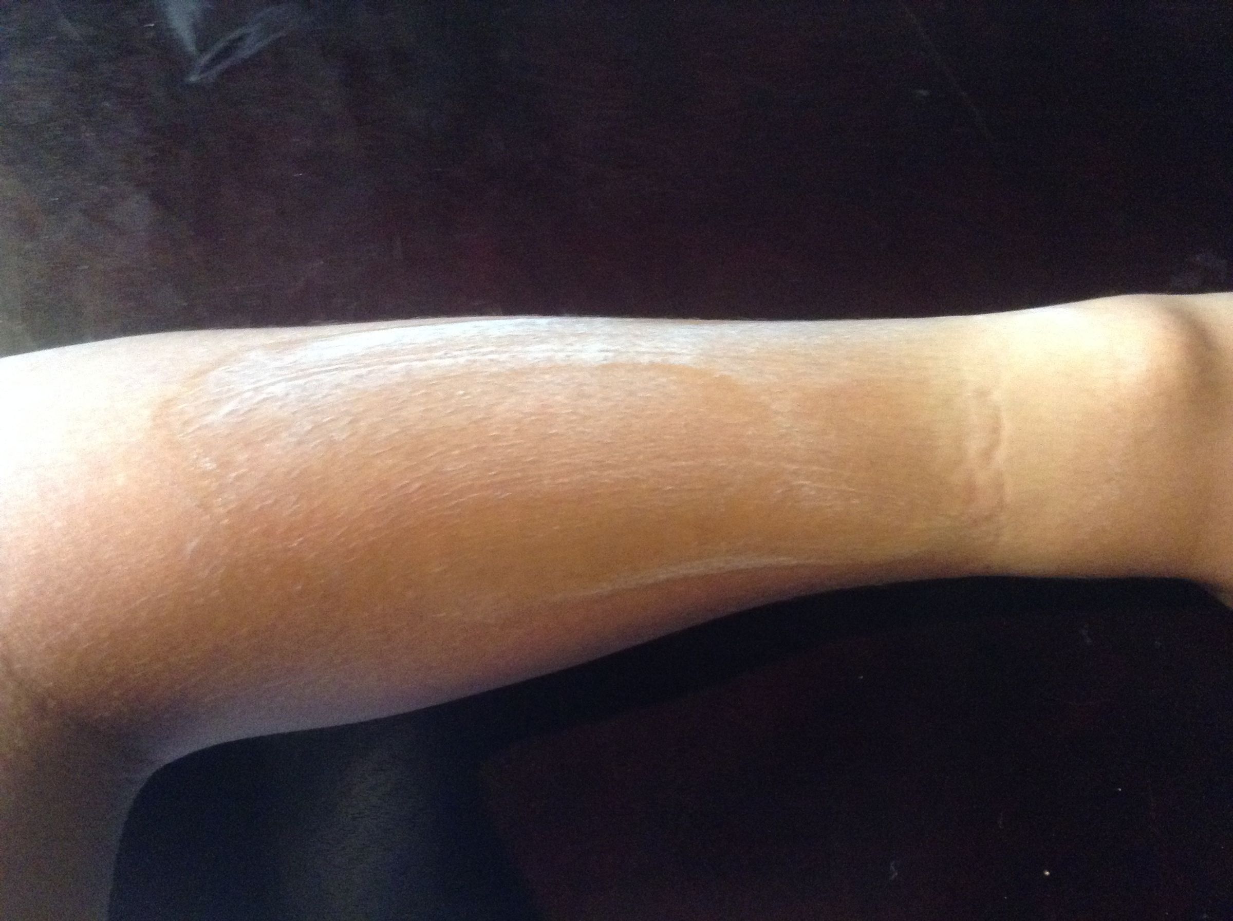 How to Scrape Your Arm : 5 Steps - Instructables