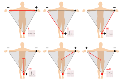 Designing a Functional ECG With Arduino Output : 7 Steps - Instructables