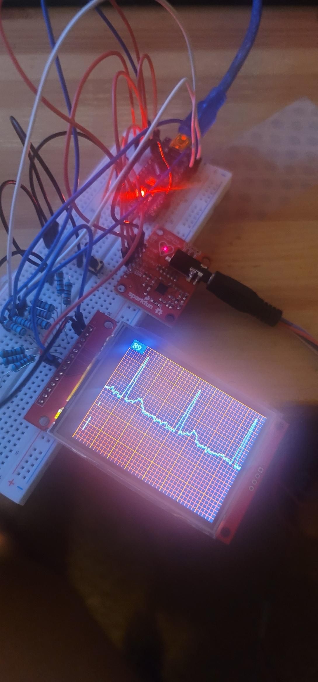 ECG Display With Arduino : 13 Steps (with Pictures) - Instructables