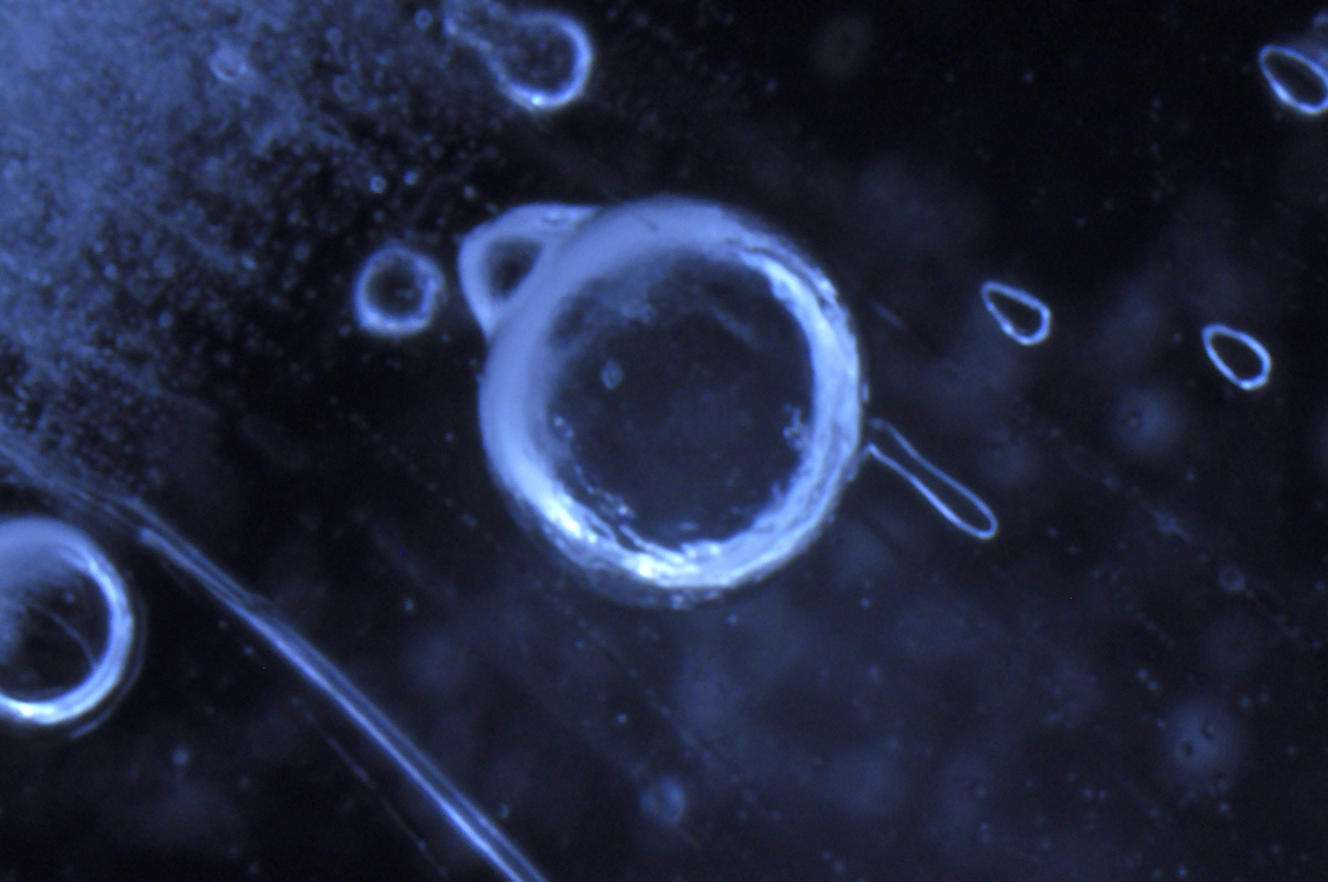 Macro Photography and Photomicroscopy : 9 Steps (with Pictures ...