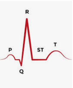 Functional ECG to Plot Biosignals and BPM Readout : 14 Steps - Instructables