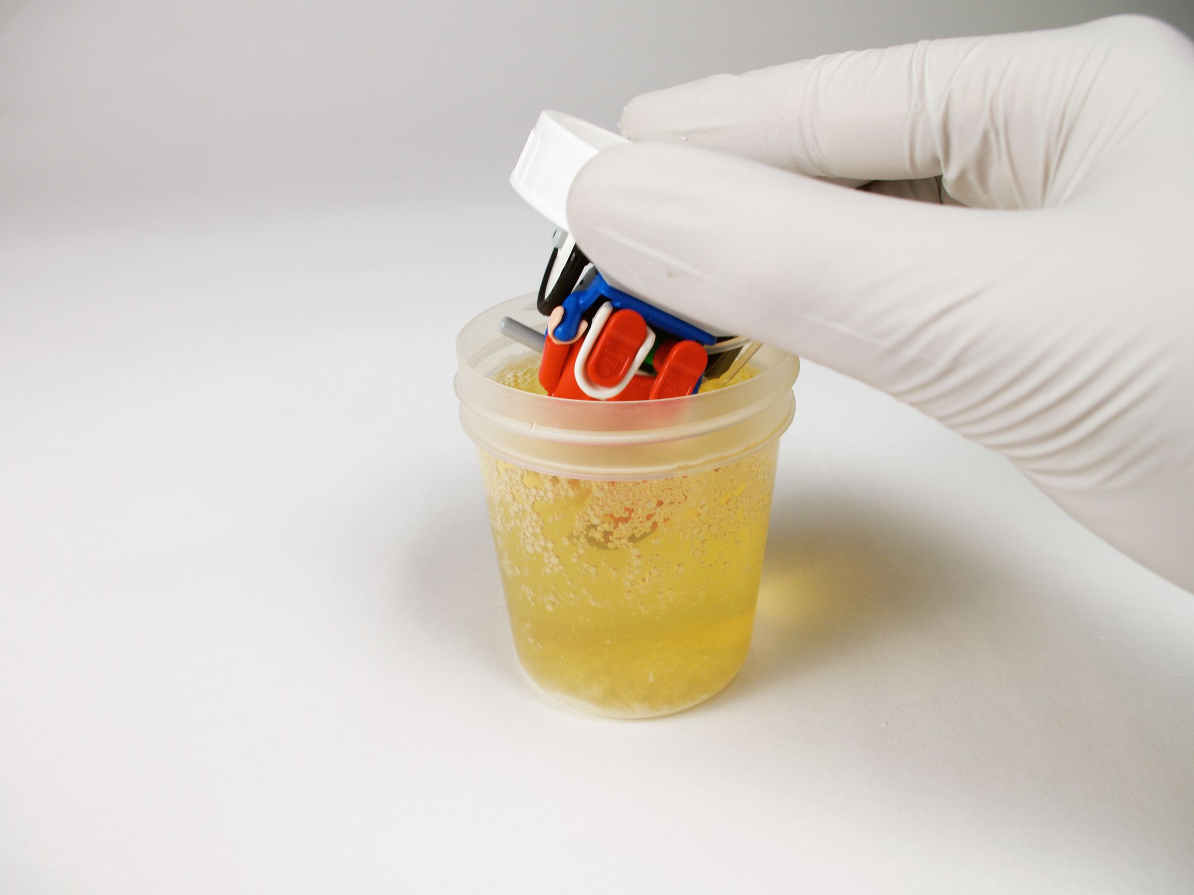 Urine Snow Globe : 14 Steps - Instructables