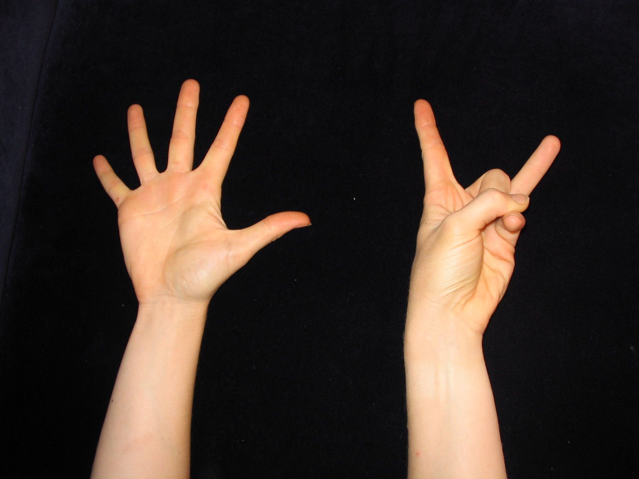 Mouse Toe Numbering Scheme : 5 Steps - Instructables