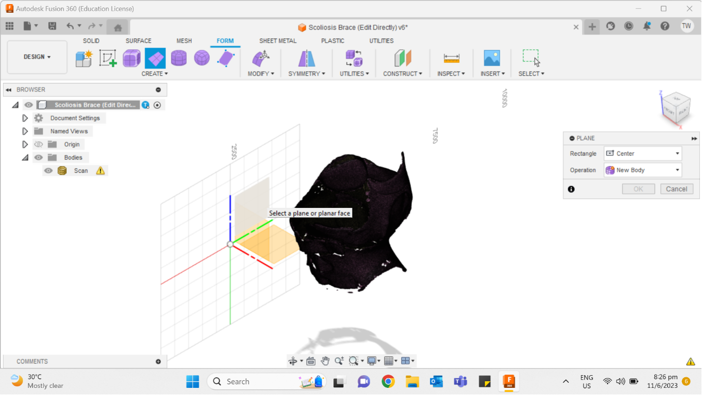 3D Printed Back Brace for Scoliosis : 7 Steps (with Pictures ...