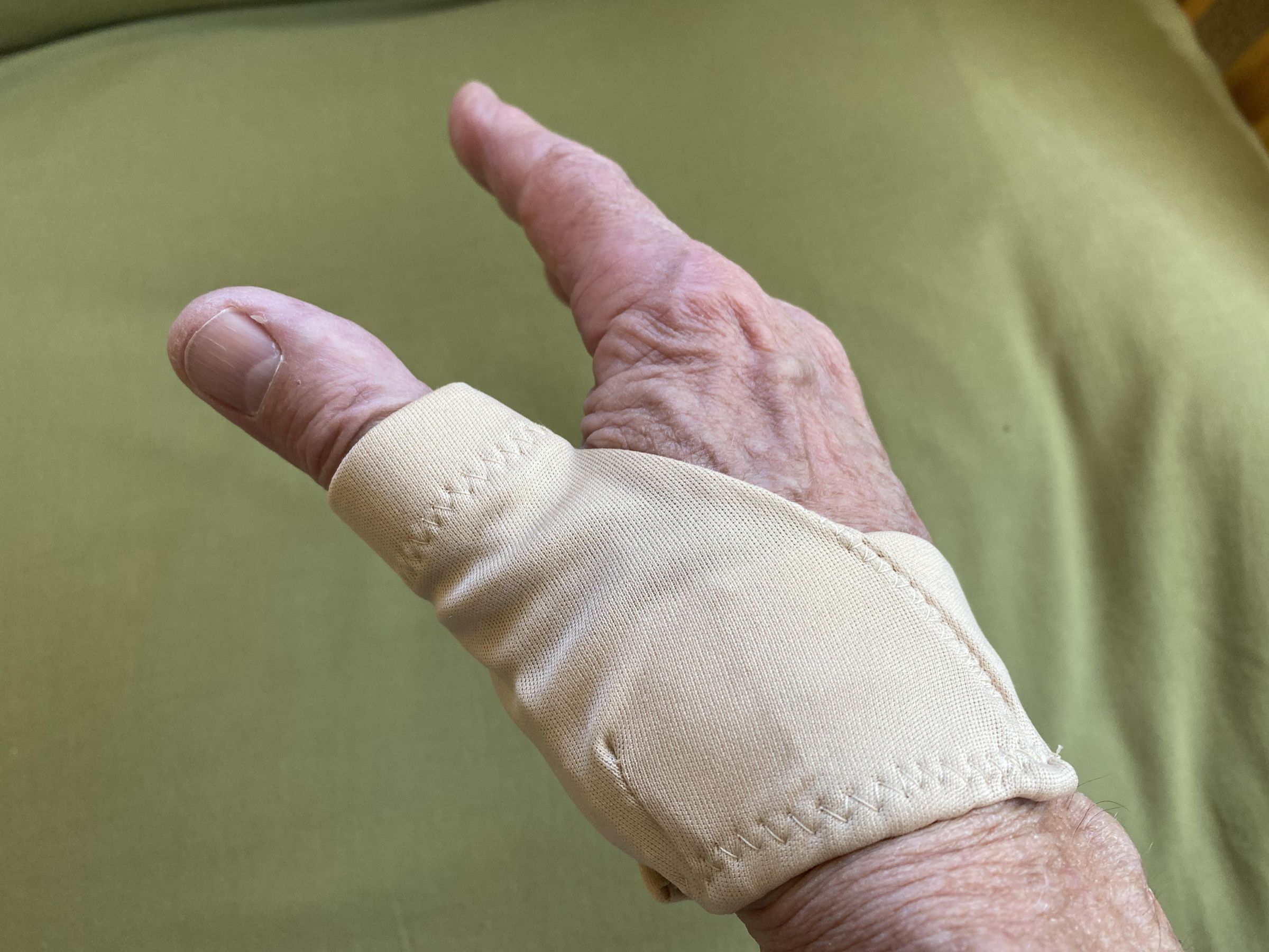 Thumb Spica Splint Plaster