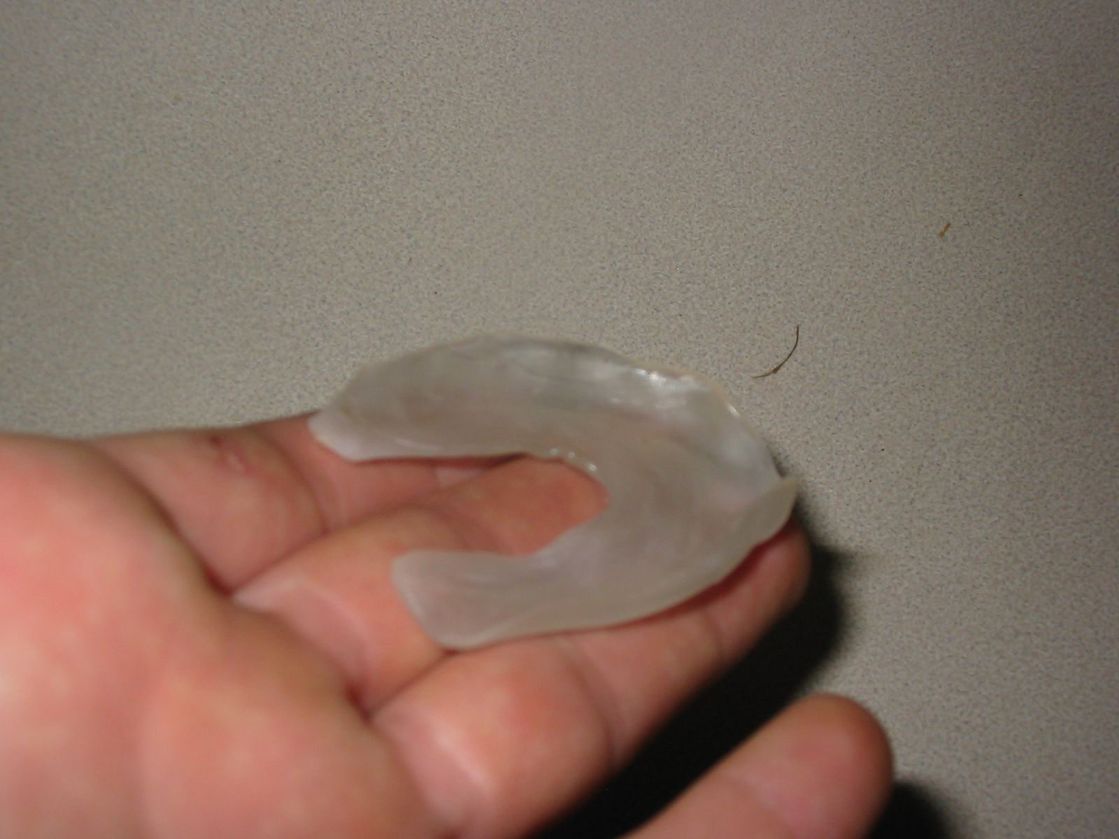 Make a Night Time Orthodontic Retainer : 3 Steps - Instructables