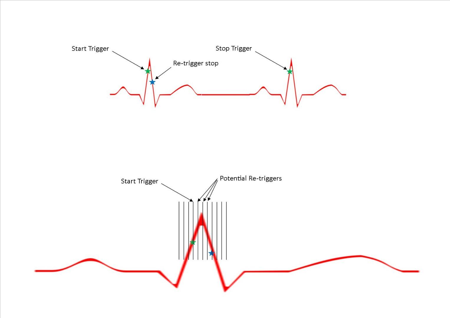 Photoplethysmography - (IR Heart Rate Monitor) : 5 Steps (with Pictures ...