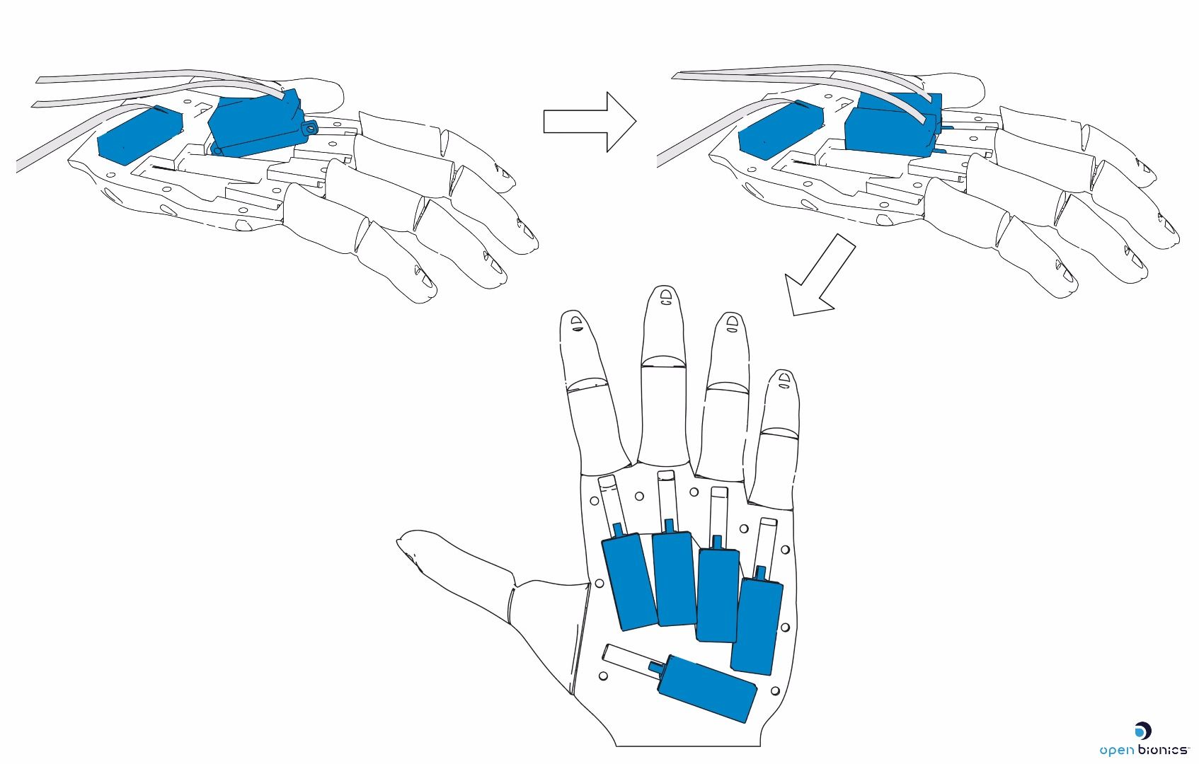 Ada Robotic Hand - Open Bionics : 8 Steps (with Pictures) - Instructables