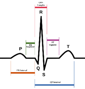 Designing a Functional ECG With Arduino Output : 7 Steps - Instructables