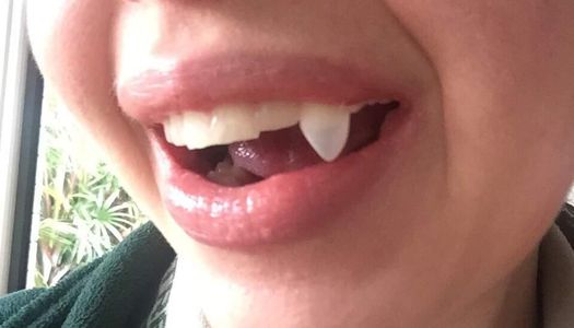 Grell Sutcliff Teeth / Vampire Fangs : 8 Steps - Instructables