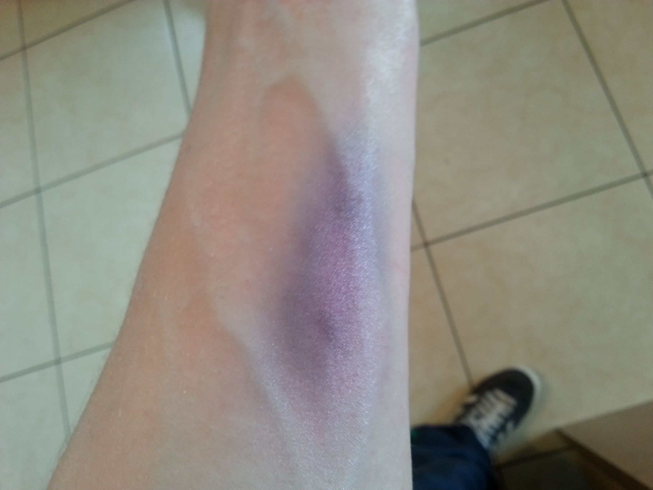 How to Create a Fake Halloween Bruise at Home.! : 6 Steps - Instructables