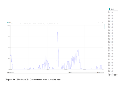 Introduction to Functional ECG Circuit : 8 Steps - Instructables